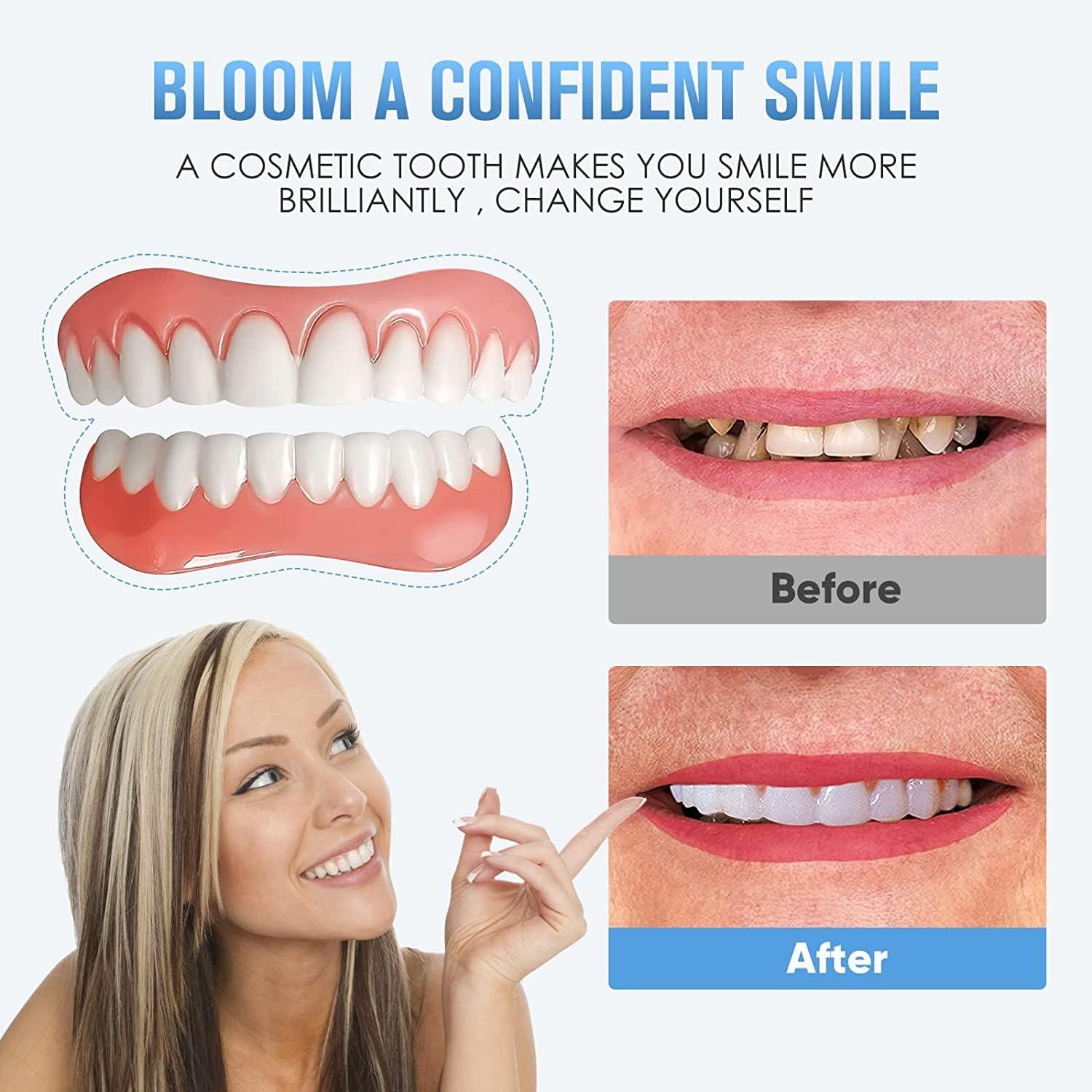 Top and Bottom Veneer Fake Teeth for Cosmetic Smile Makeover - Natural ...