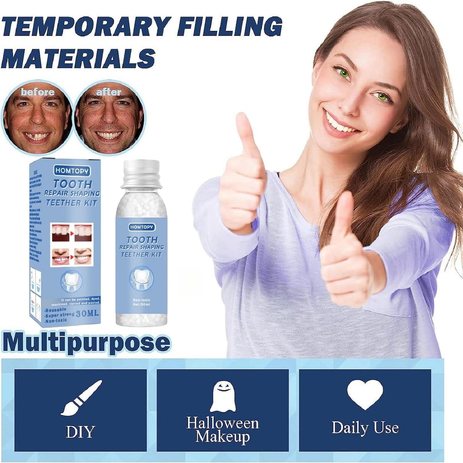 Temporary Tooth Filling Repair Kit - Dental Tooth Filler for Missing or ...