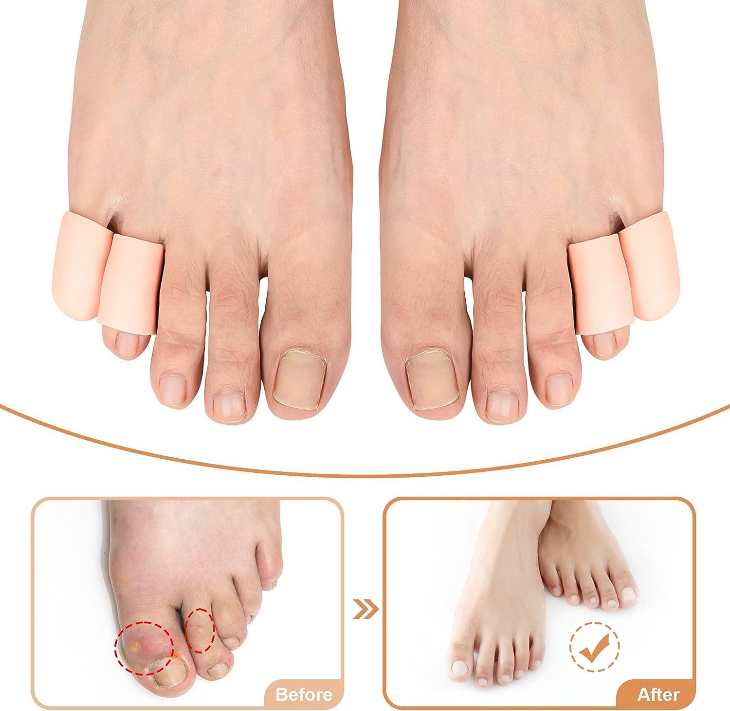 Hoogoo Pinky Toe Caps - 10 Pcs Silicone Small Toe Protector Cover ...