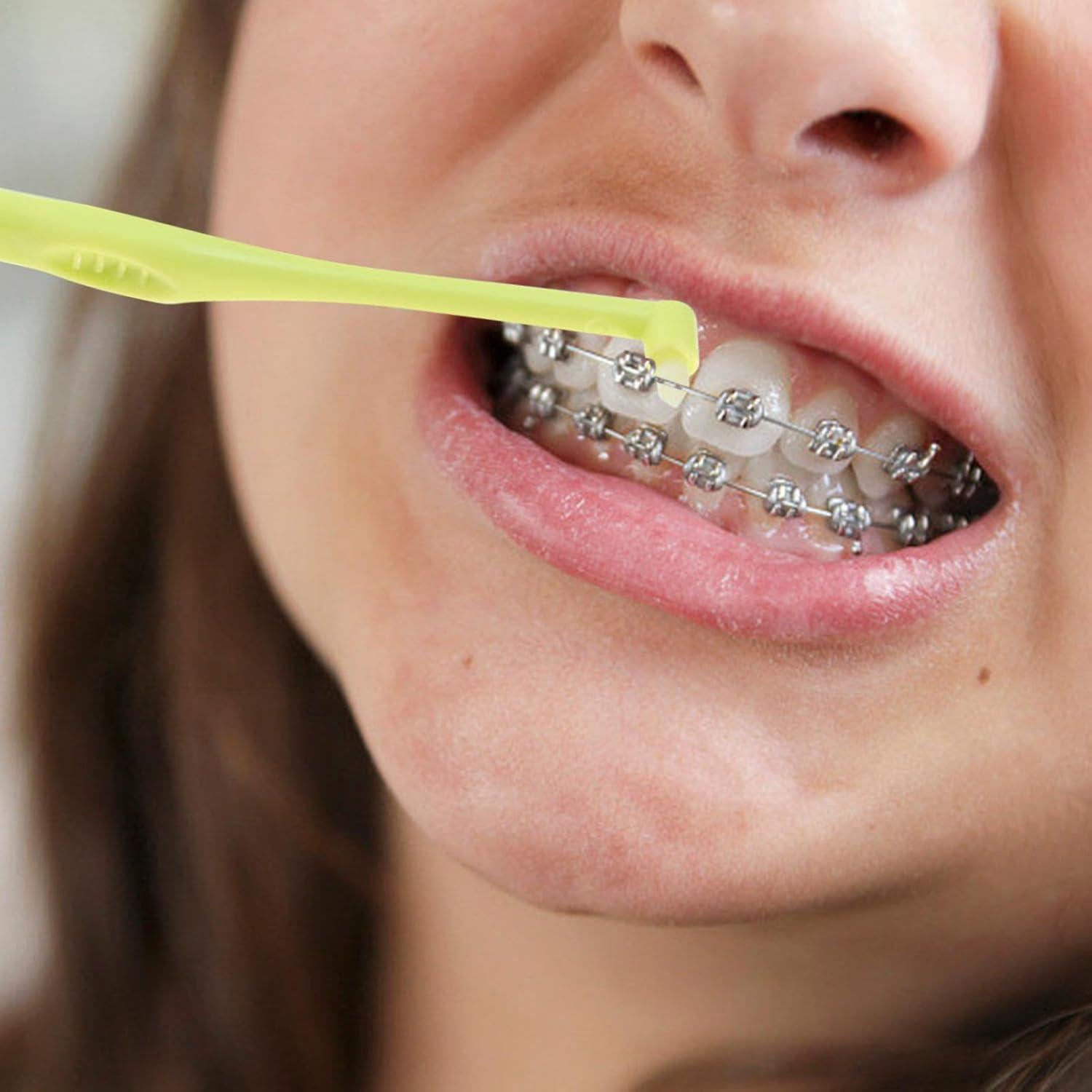 Soft Trim Dental Brush for Orthodontic Care | Compact Interdental Brush ...