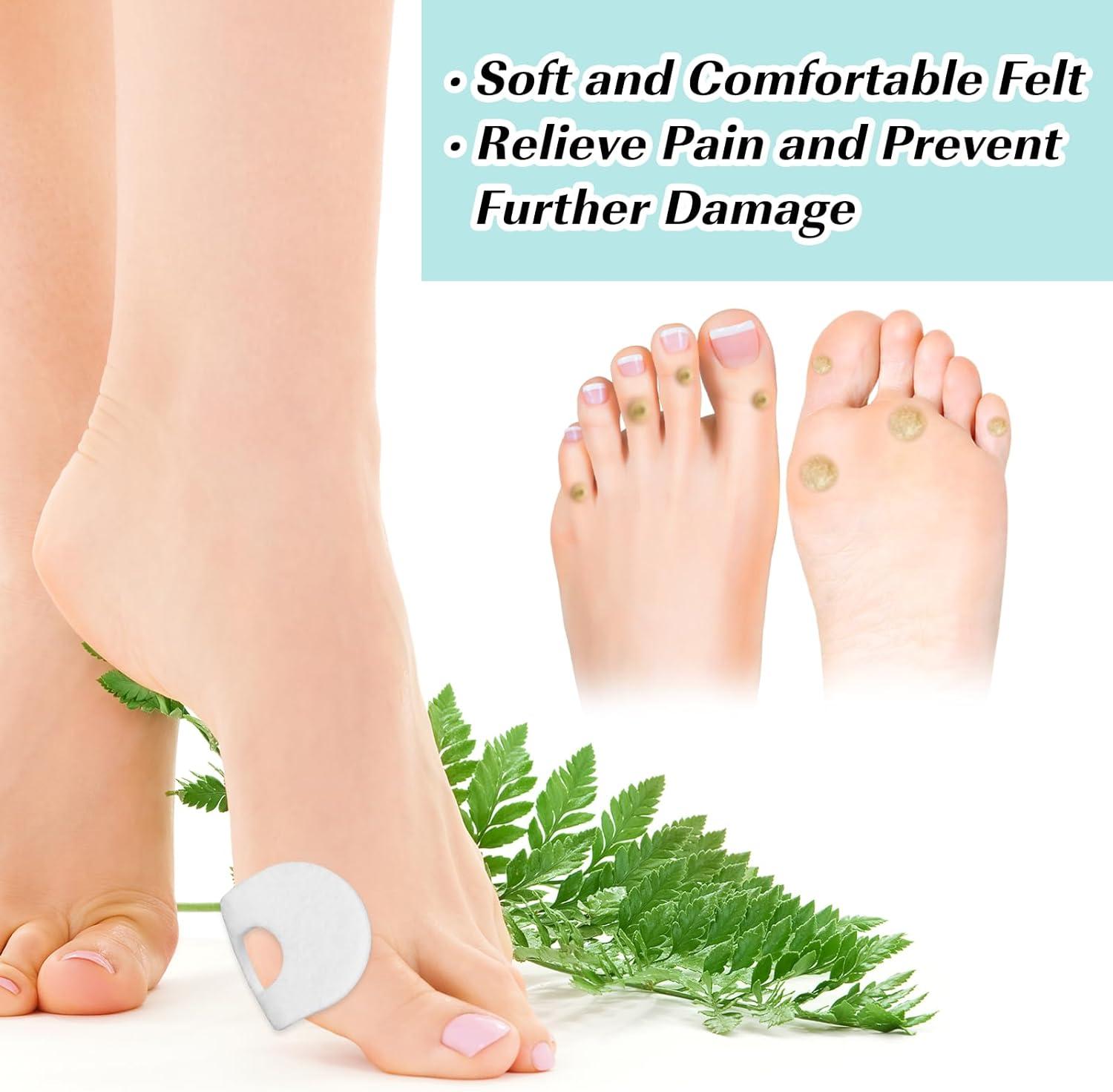 Aster 30 Pack Corn Pads for Bottom of Foot Soft Felt Oval Shape Callus ...