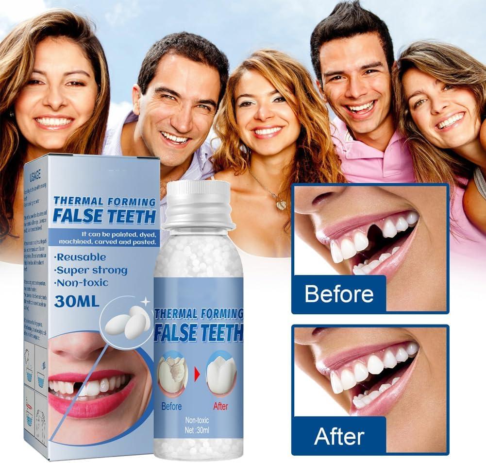 Browsluv DIY Tooth Repair Kit - 2023's Best Temporary & Permanent Tooth ...