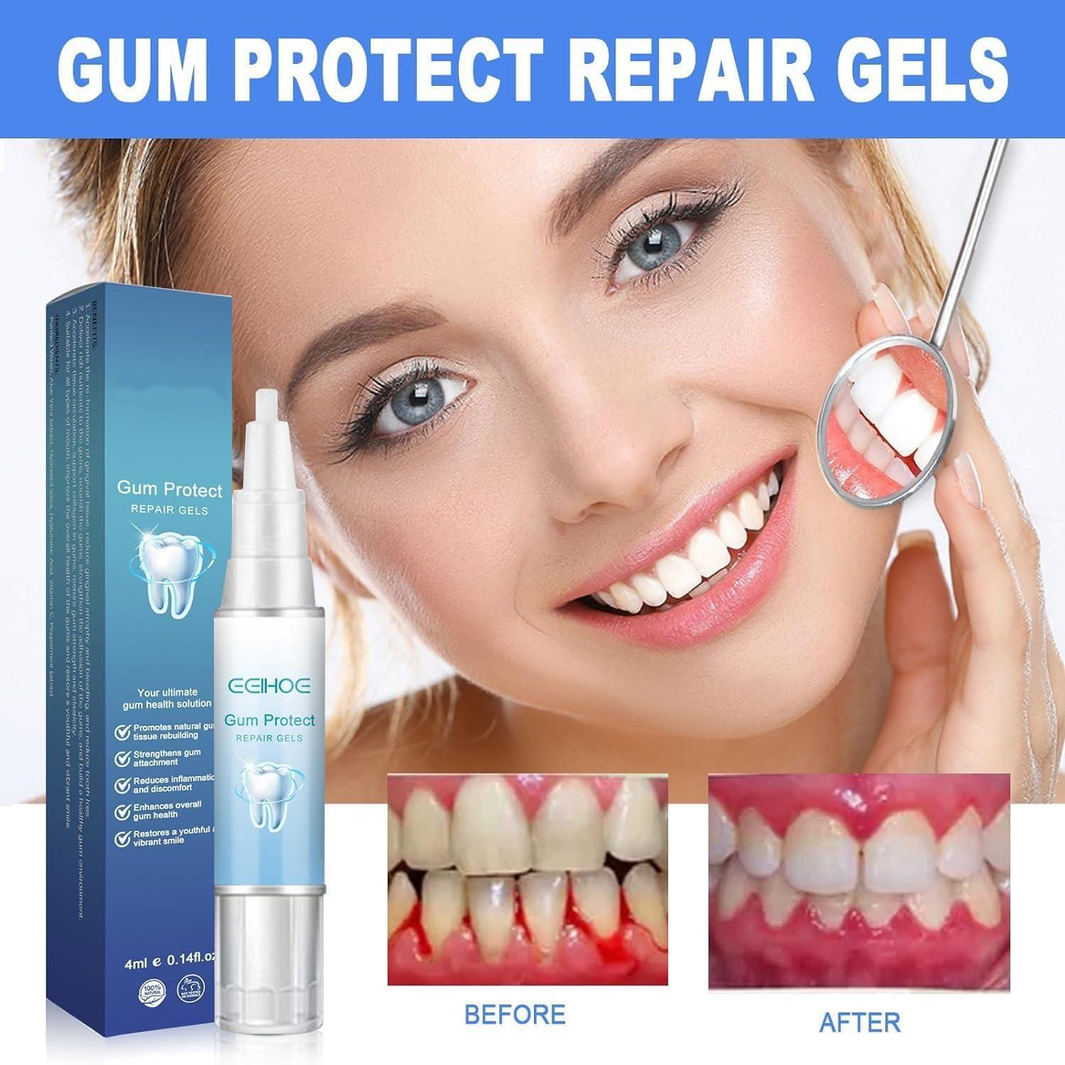 Premium Gum Shield Therapy Gel & Teeth Whitening Pen - Instant ...