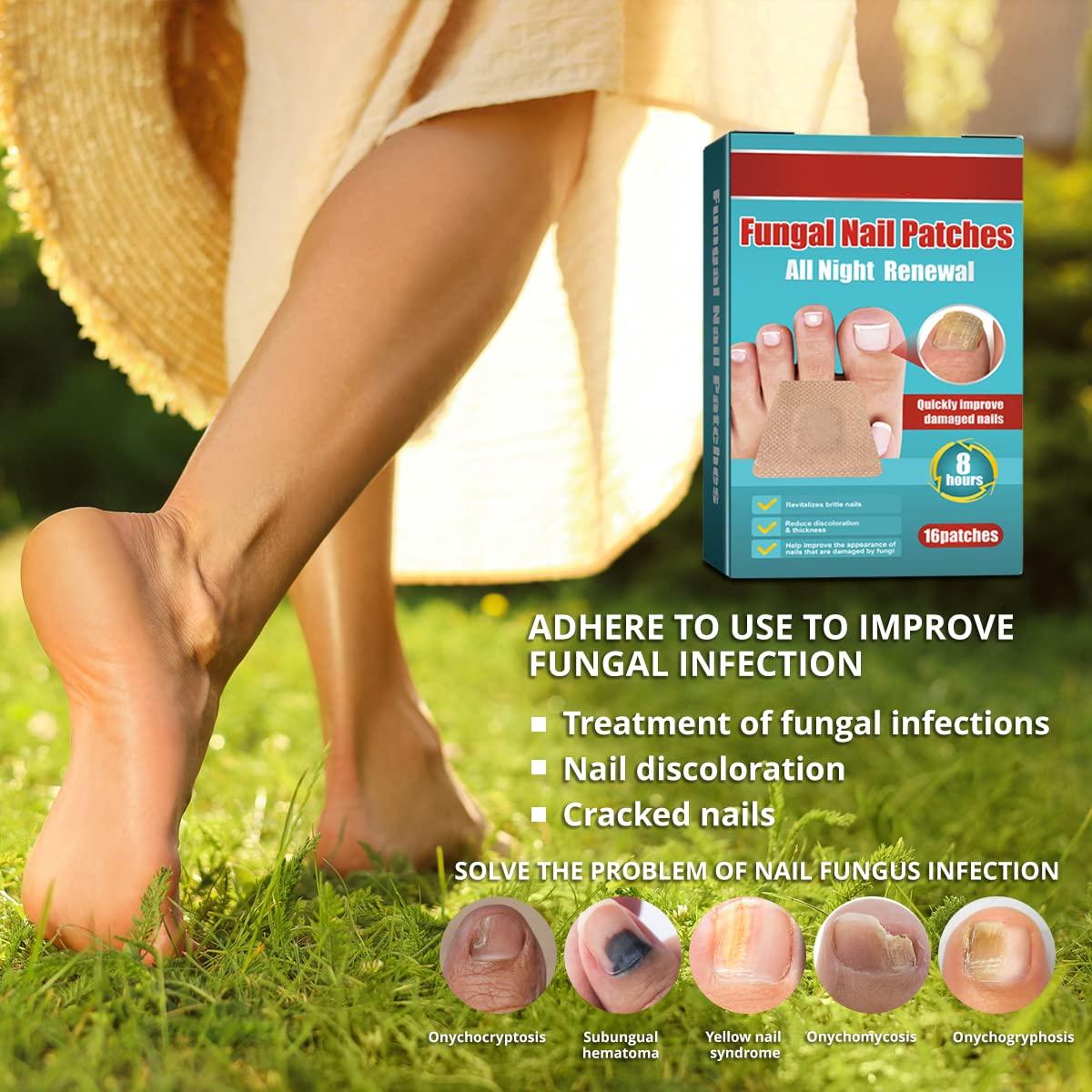 8-Hour Overnight Nail Repair Patches - 48Pcs (3 Packs) for Damaged ...