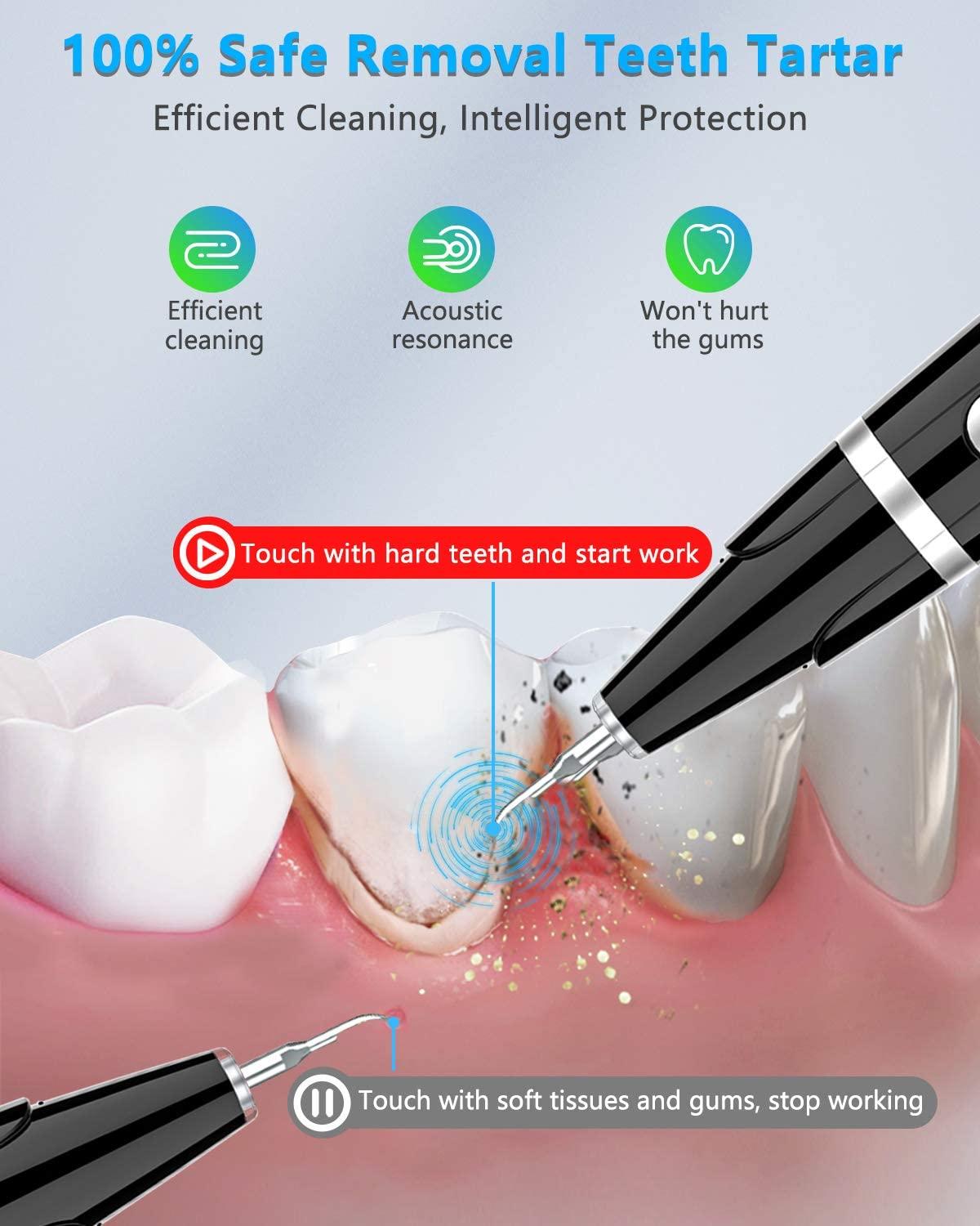 Ultrasonic Tooth Cleaner - Plaque Remover with LED, 5 Modes - Safe ...