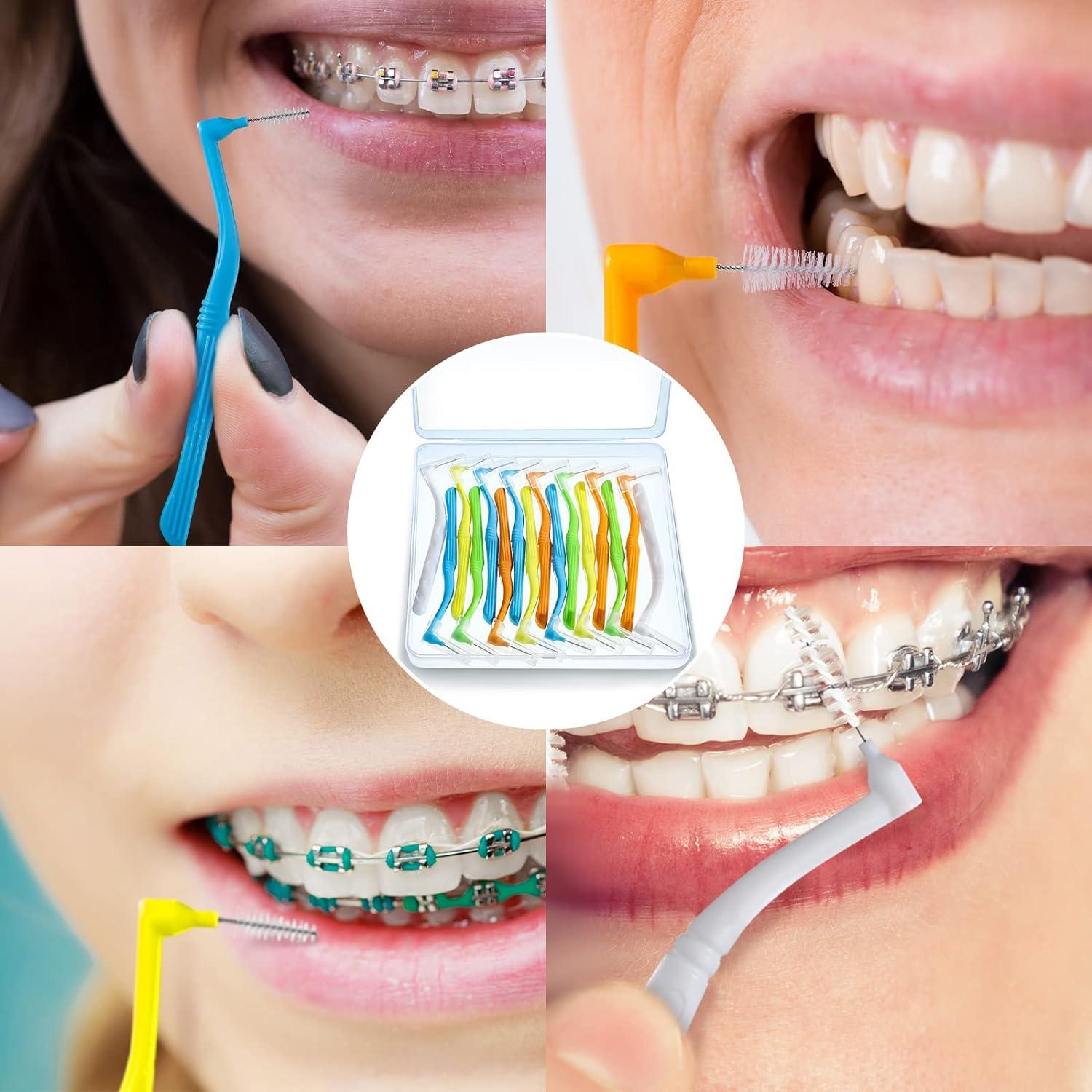 Interdental Brushes for Braces & Tooth Cleaning - 20 Pieces, Mixed ...