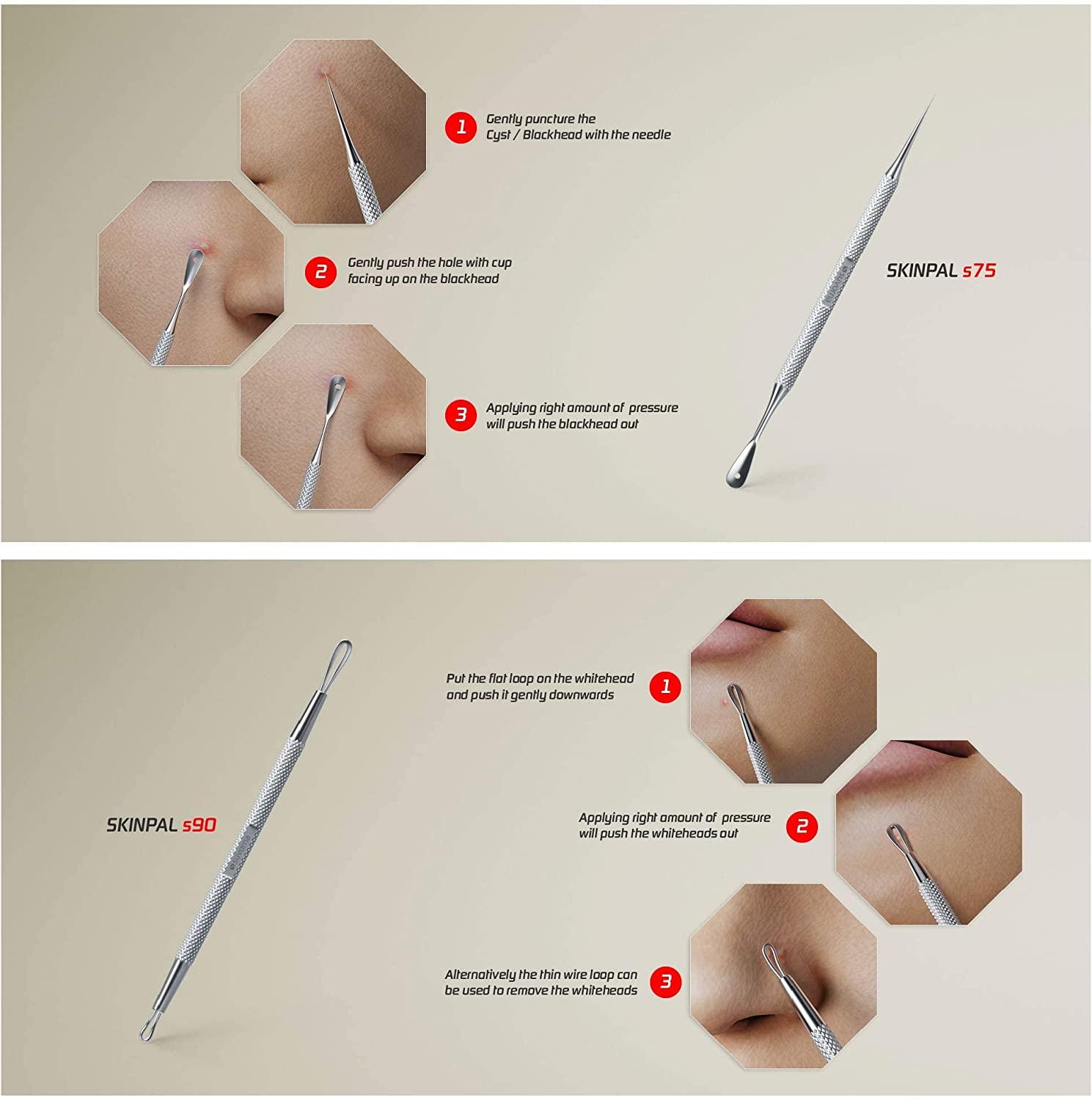 Suvorna Skinpal S100 Pimple Popper Tool Kit - Milia, Whitehead ...
