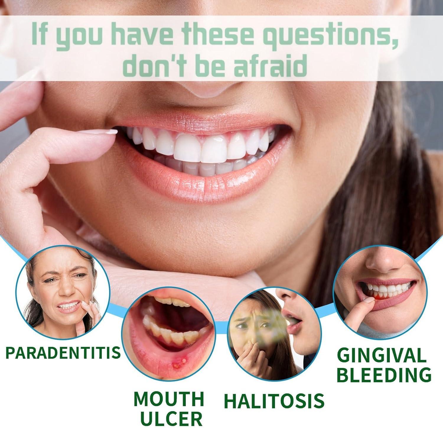 Mouth Ulcer Spray Mouth Ulcer Treatment Spray for Adluts Ulcer Breath ...