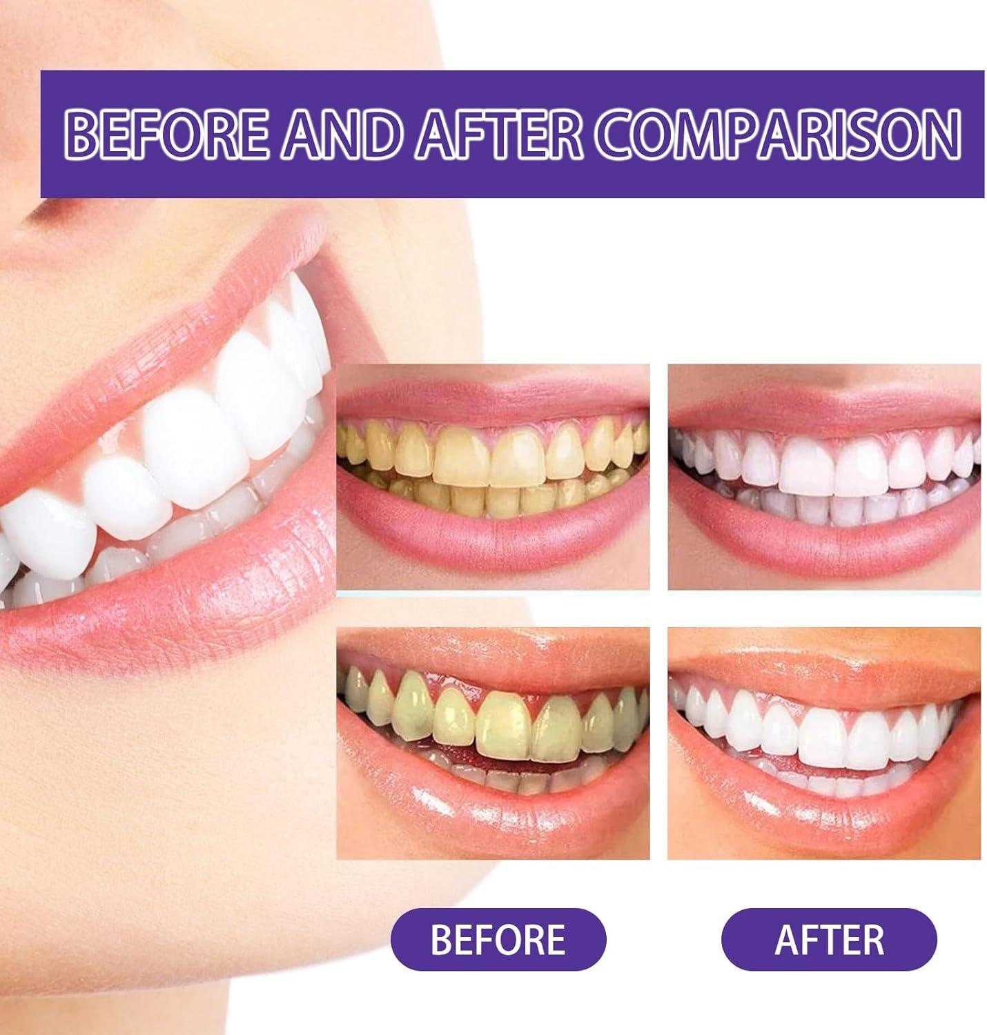 Purple Toothpaste for White Teeth | Whitening Toothpaste for a Glowing ...