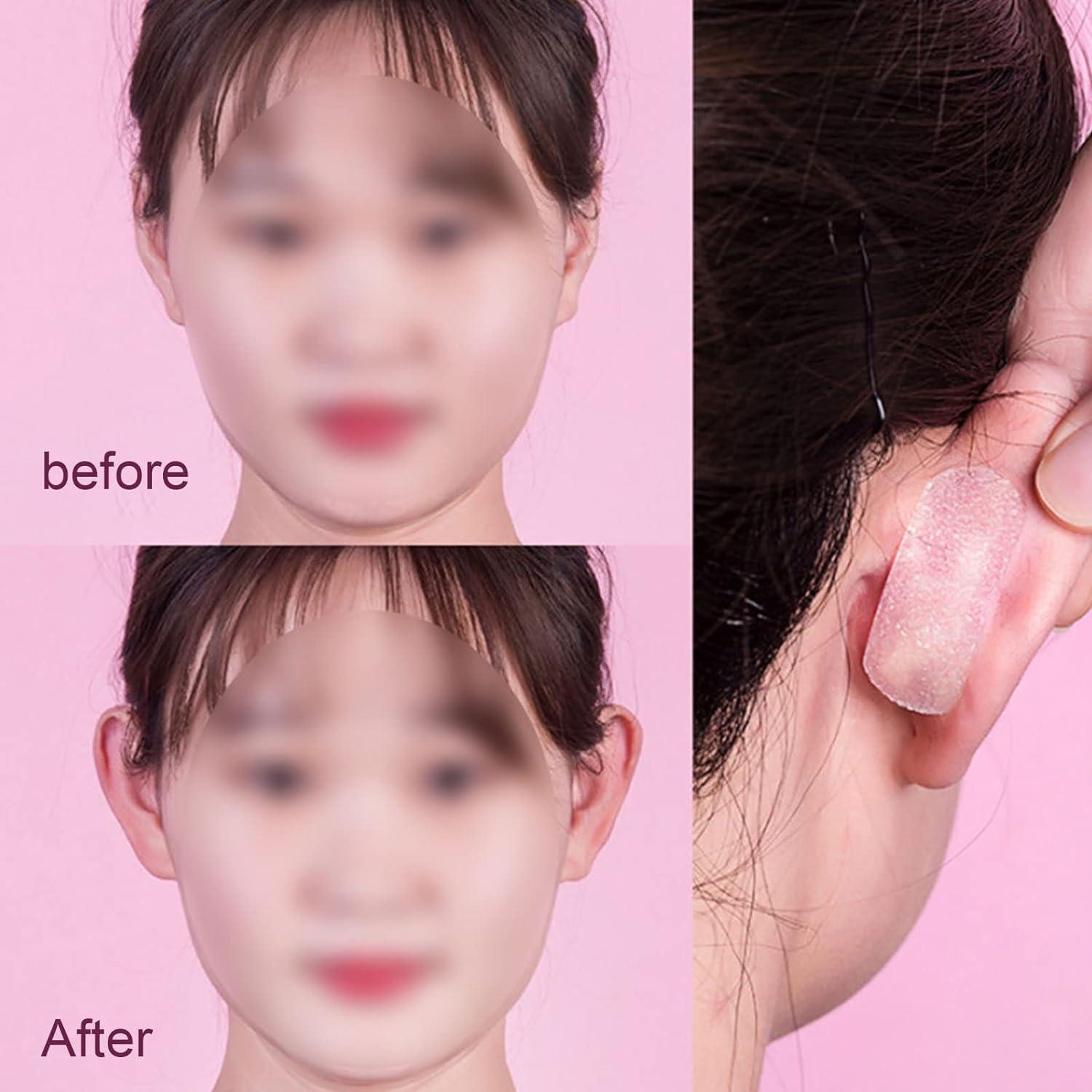 Ear Fold Corrector for Big Ears | Adult Ear Correction for Earrings