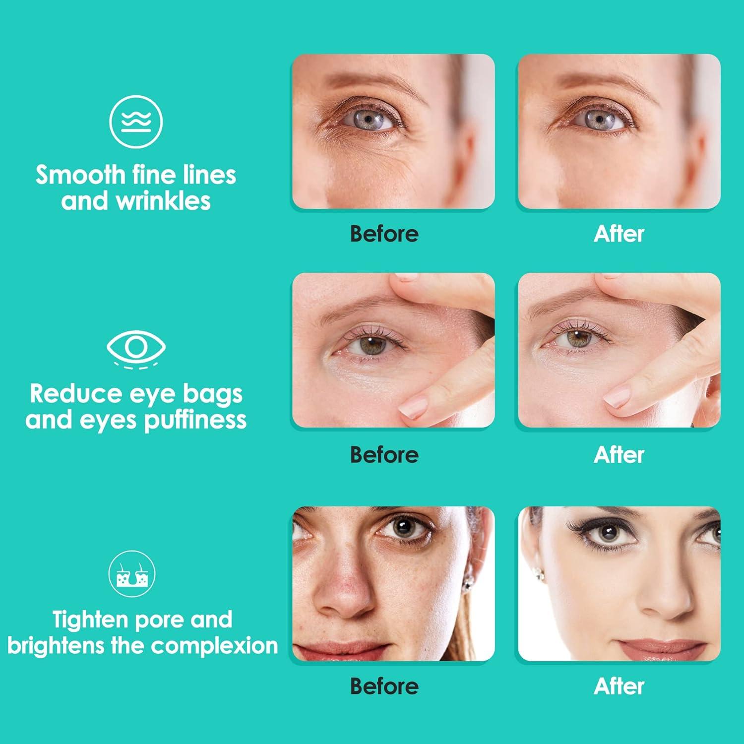 Green Ice Globes Set for Facial Cooling - Reduce Puffiness, Dark ...