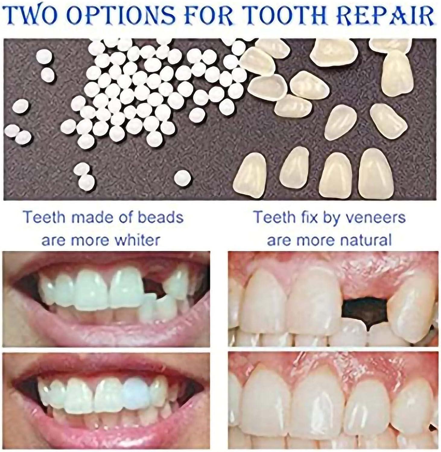 OTCPP Temporary Tooth Repair Kit Temporary Tooth Repair kit for Filling ...