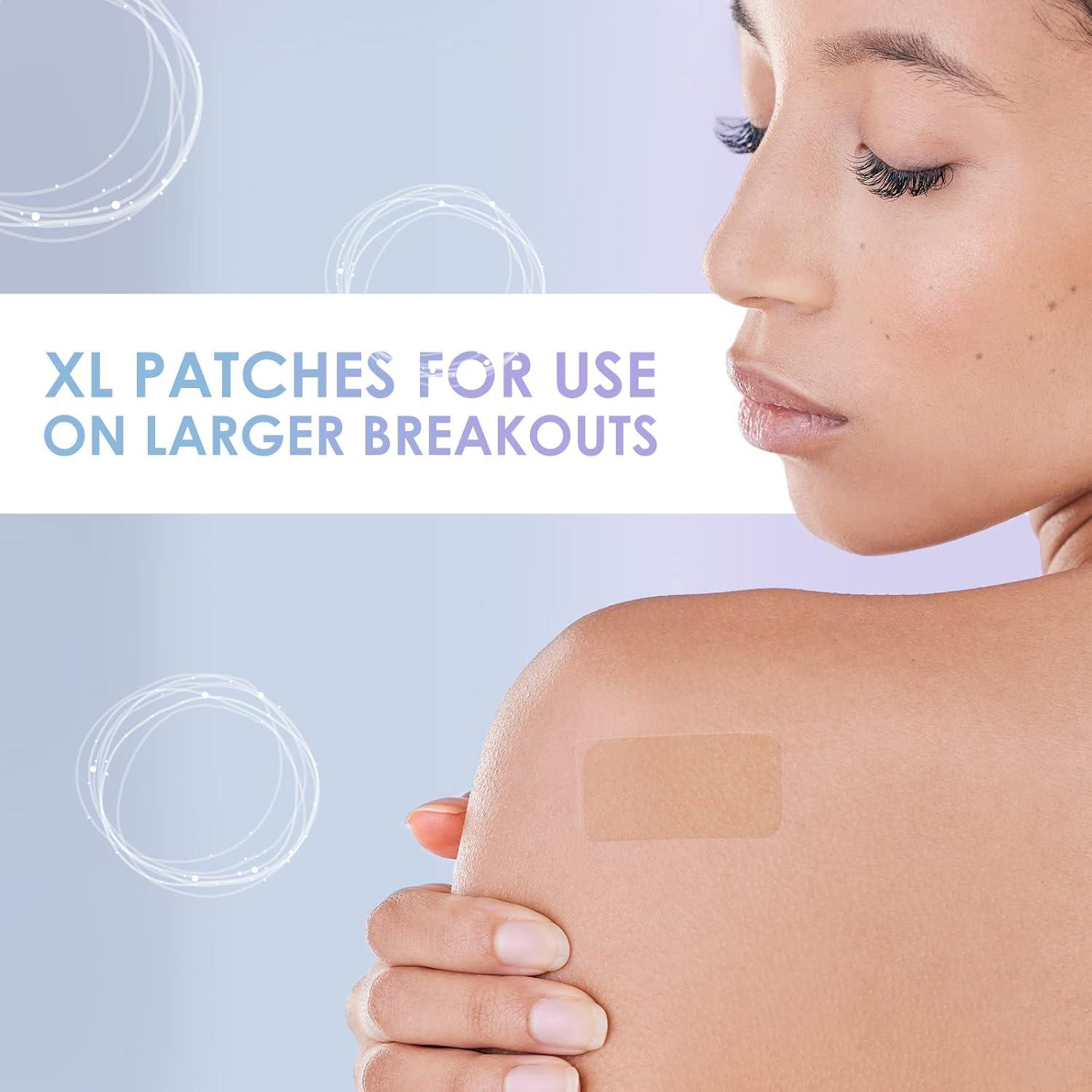 AUSLKA Acne Pimple Patch XL - 18 Hydrocolloid Strips for Large Pimples ...
