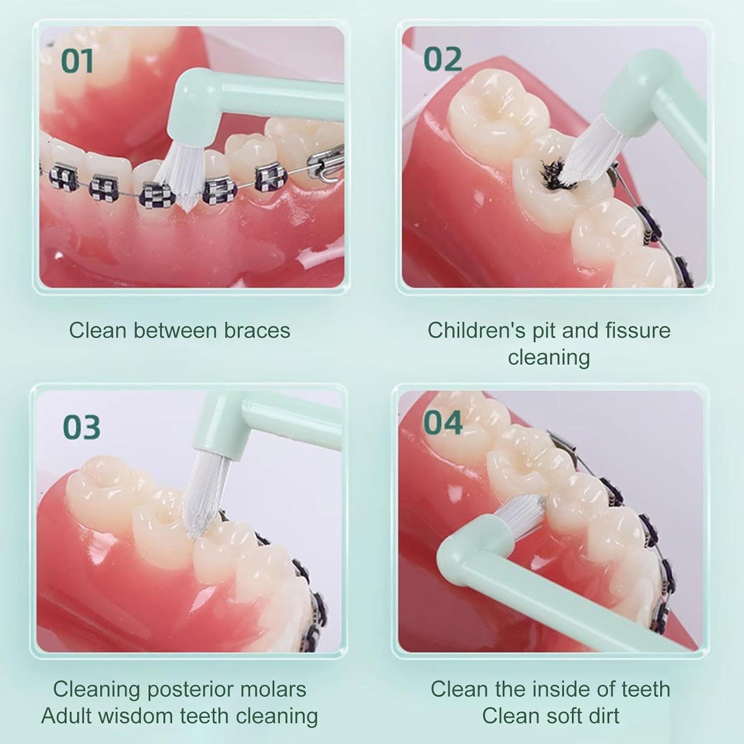 Trim Dental Brush - Soft Interdental Toothbrush for Orthodontic Care ...