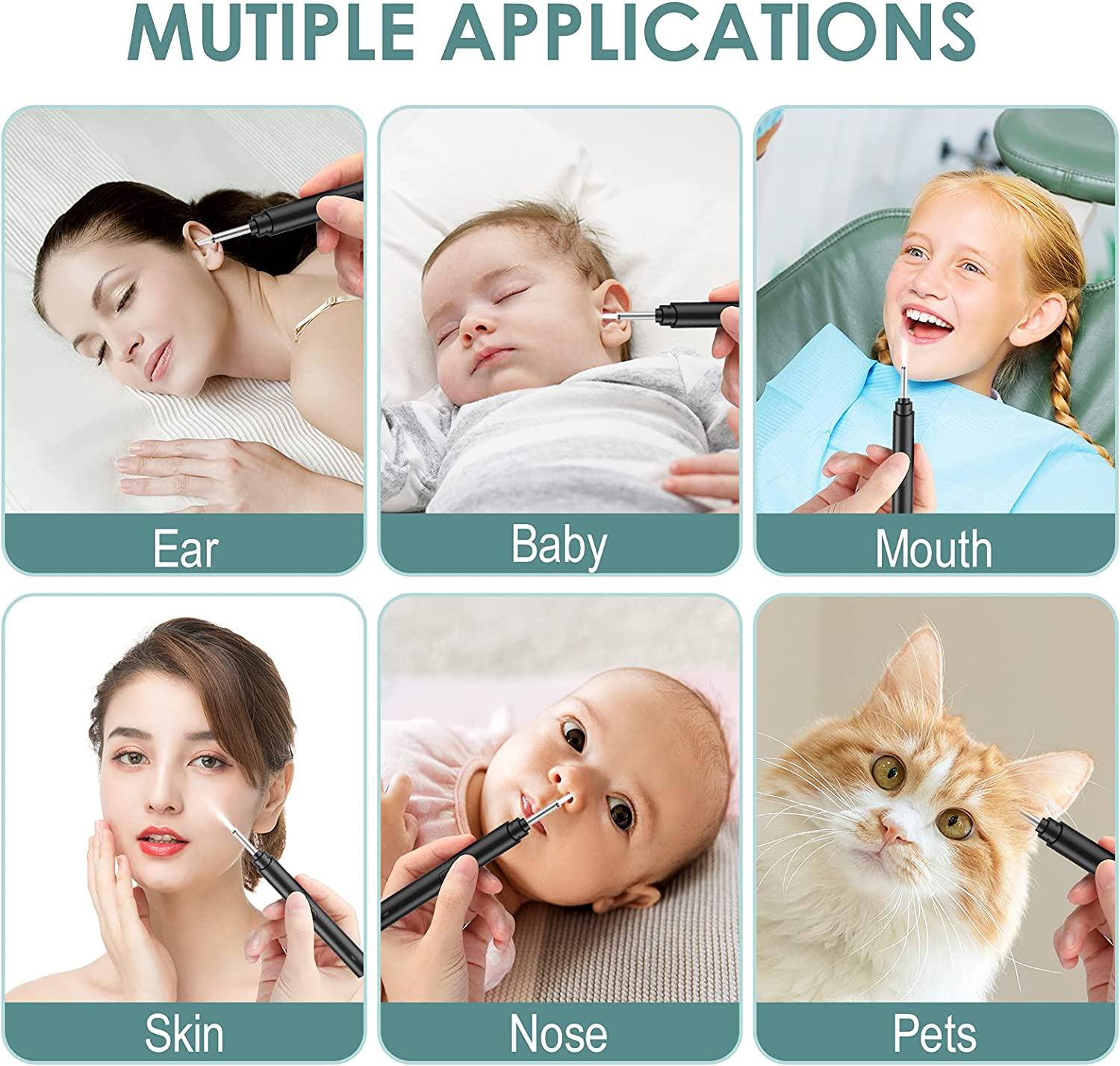 Smart Visual Ear Cleaner | Wireless Ear Wax Removal Tool Camera | 1296P ...