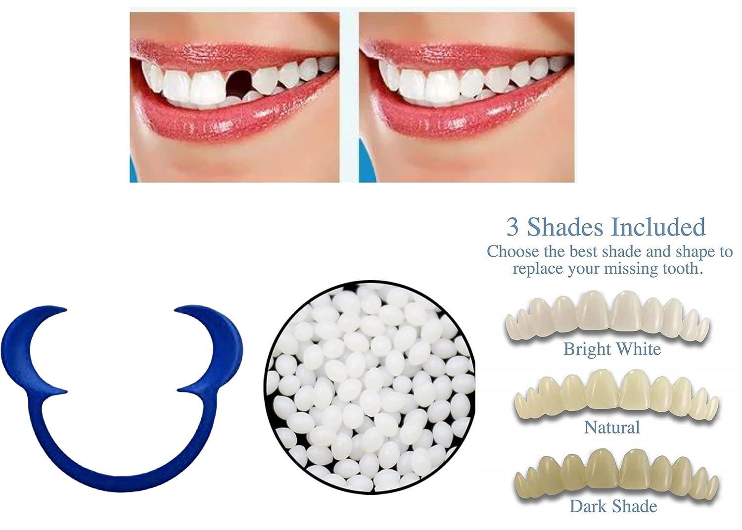 temporary tooth replacement options