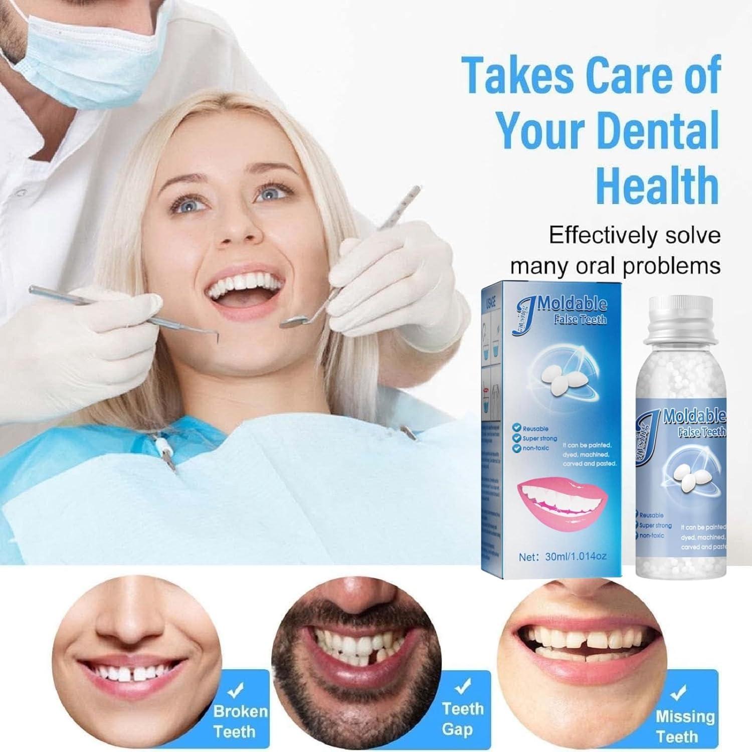 DIY Moldable False Teeth Repair Kit - Instant Tooth Filling Replacement ...