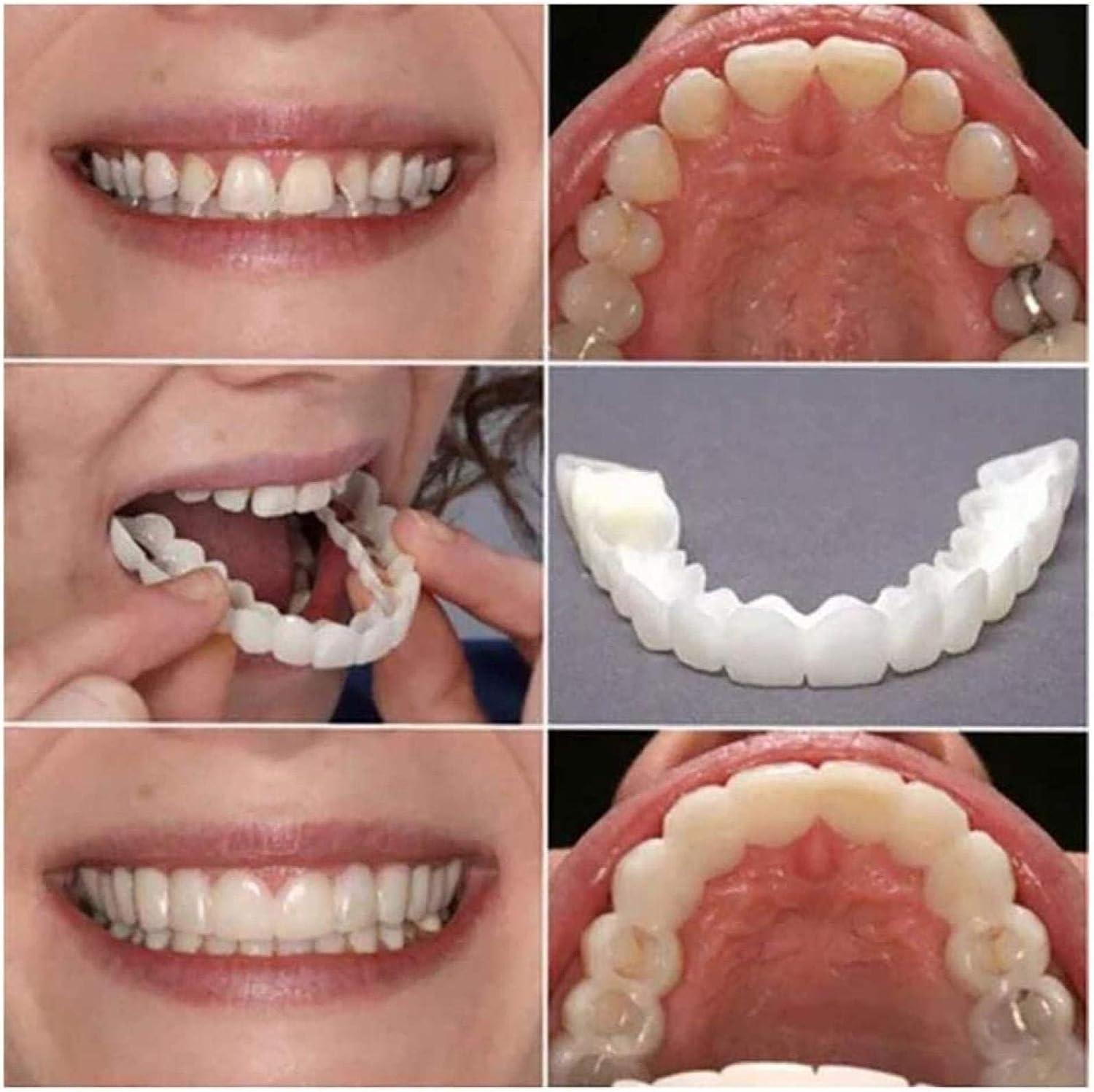 XLBHSH 4 Pairs Cosmetic Tooth Veneers Teeth Temporary Dentures Top and ...