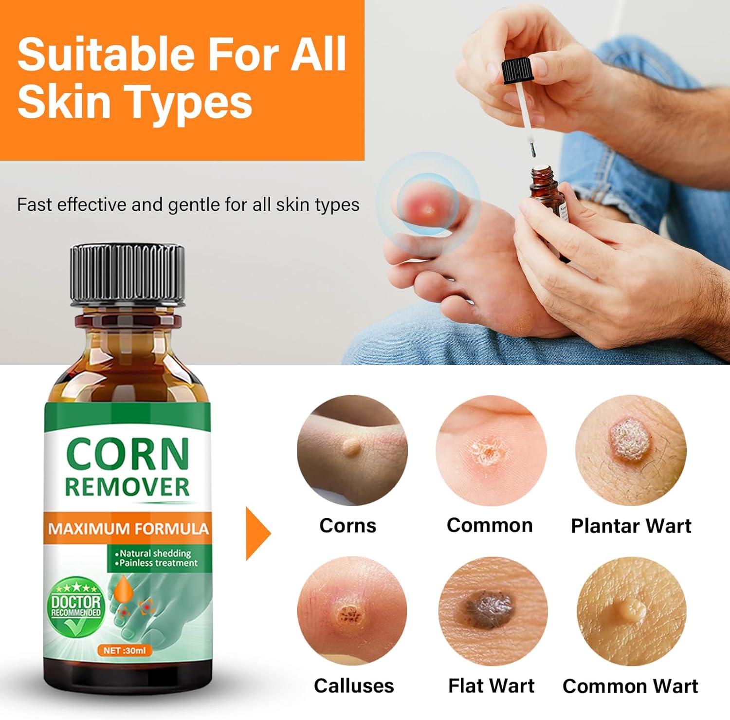 Corn-Remover-for-Feet 30ml Effect Corn Removal Liquid | Buy Now with ...