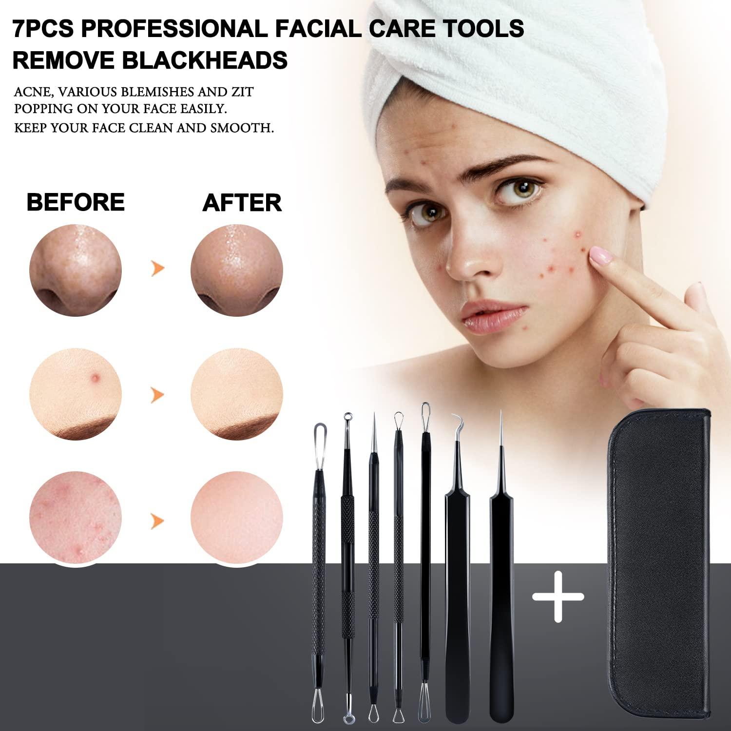 Pore Removal Tool Acne Blackhead Remover Kit | 7Pcs Stainless Steel ...
