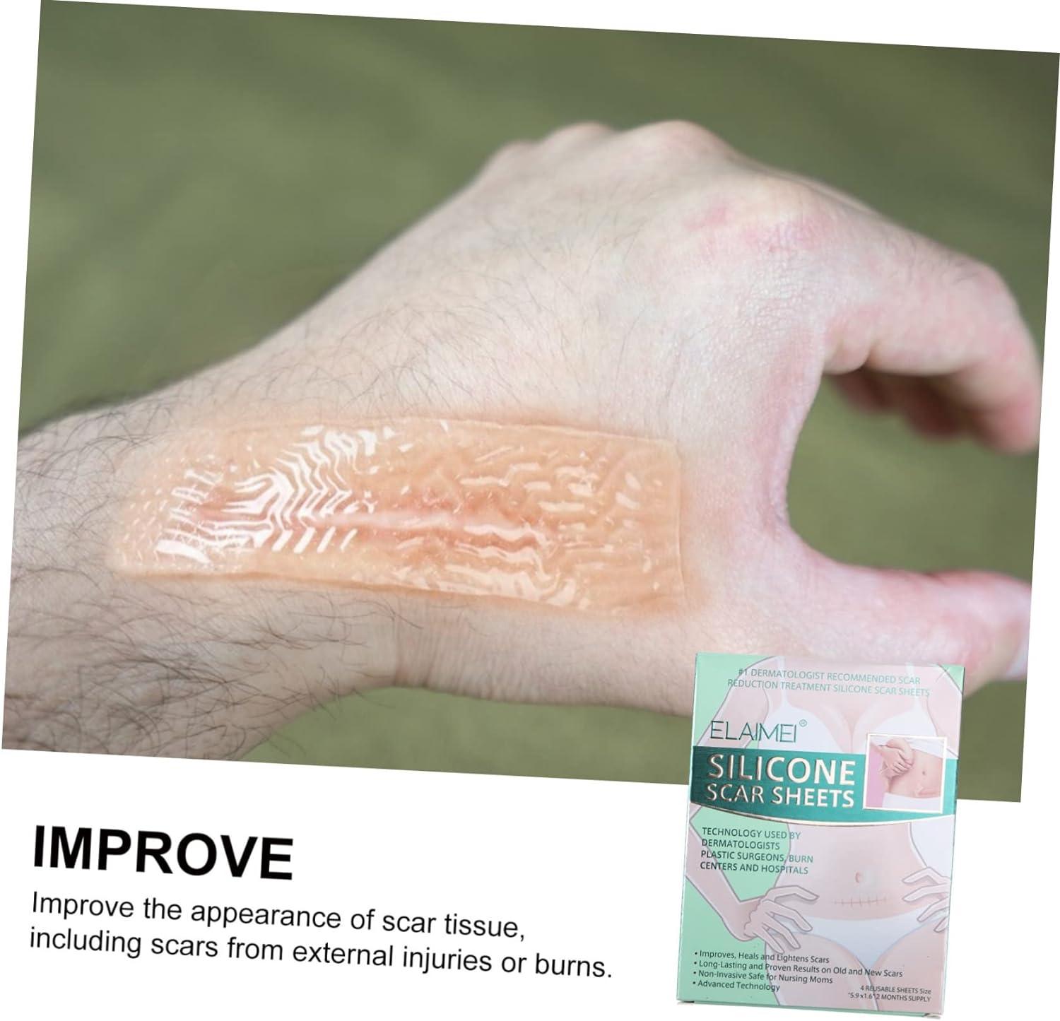 Caesarean Section Scar Cover Up - 4PCS Scar Care Dressings | Buy Now ...