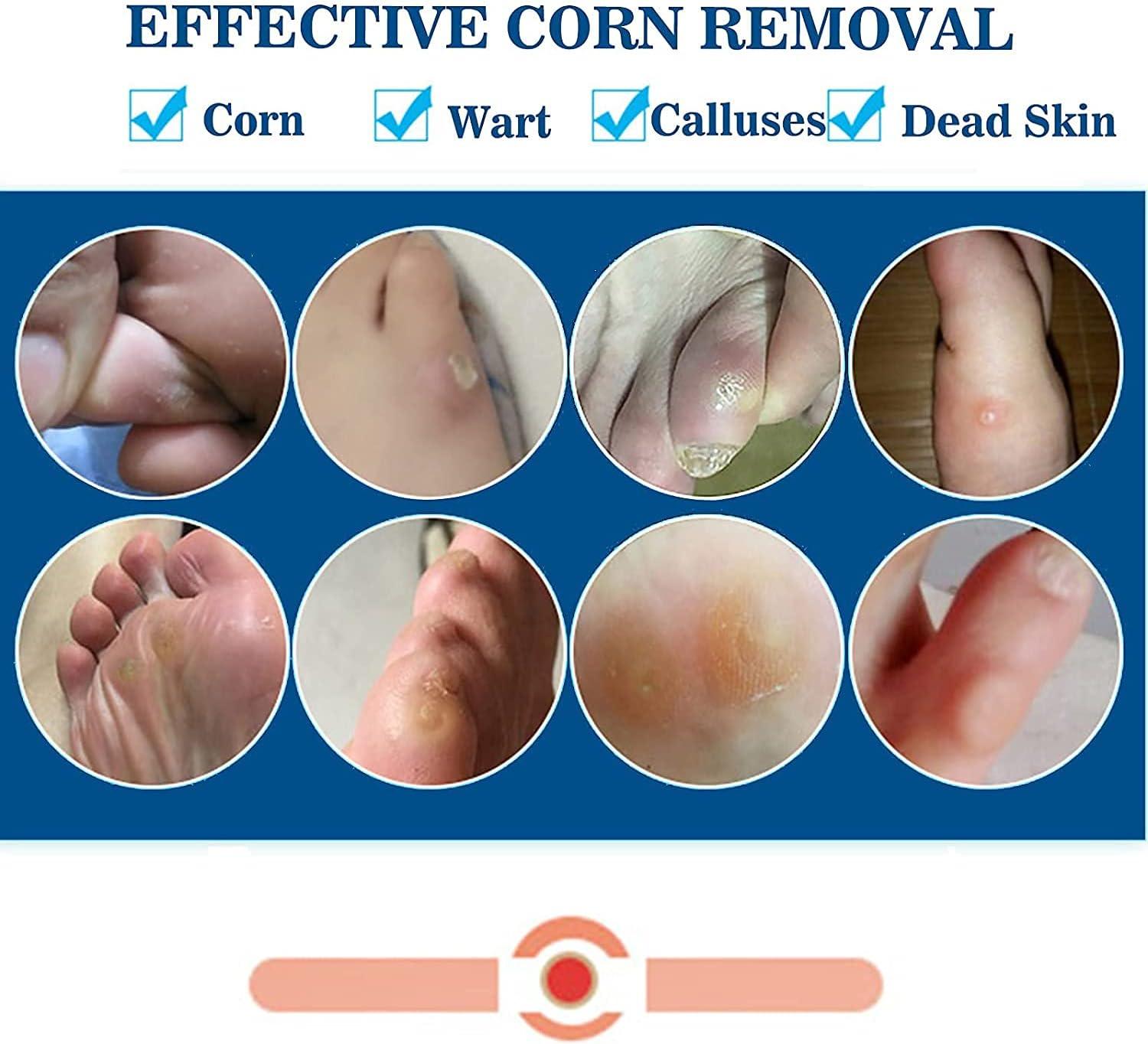 corn root removal