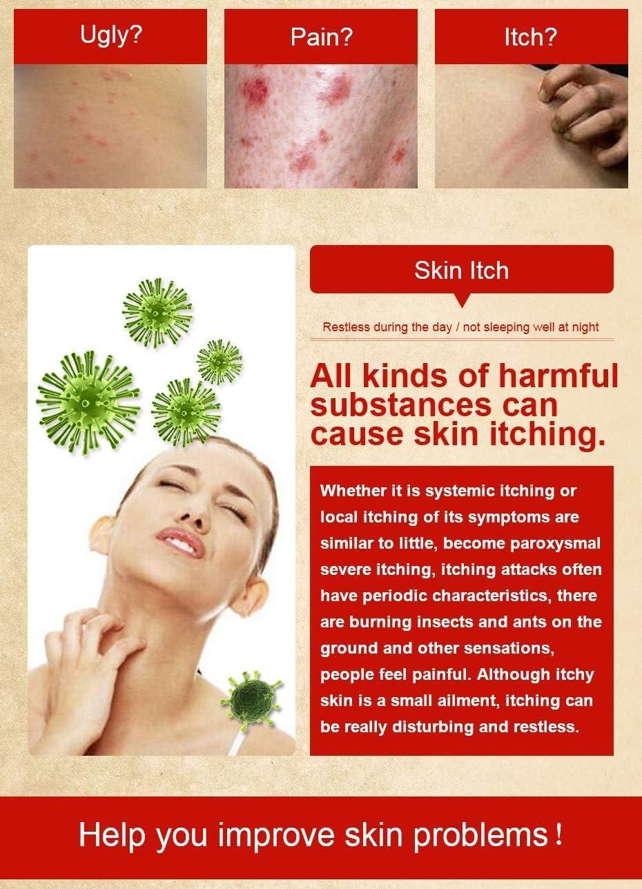 YDF Antibacterial Cream: Redness, Itchiness, Eczema, Rosacea, Cutitis ...