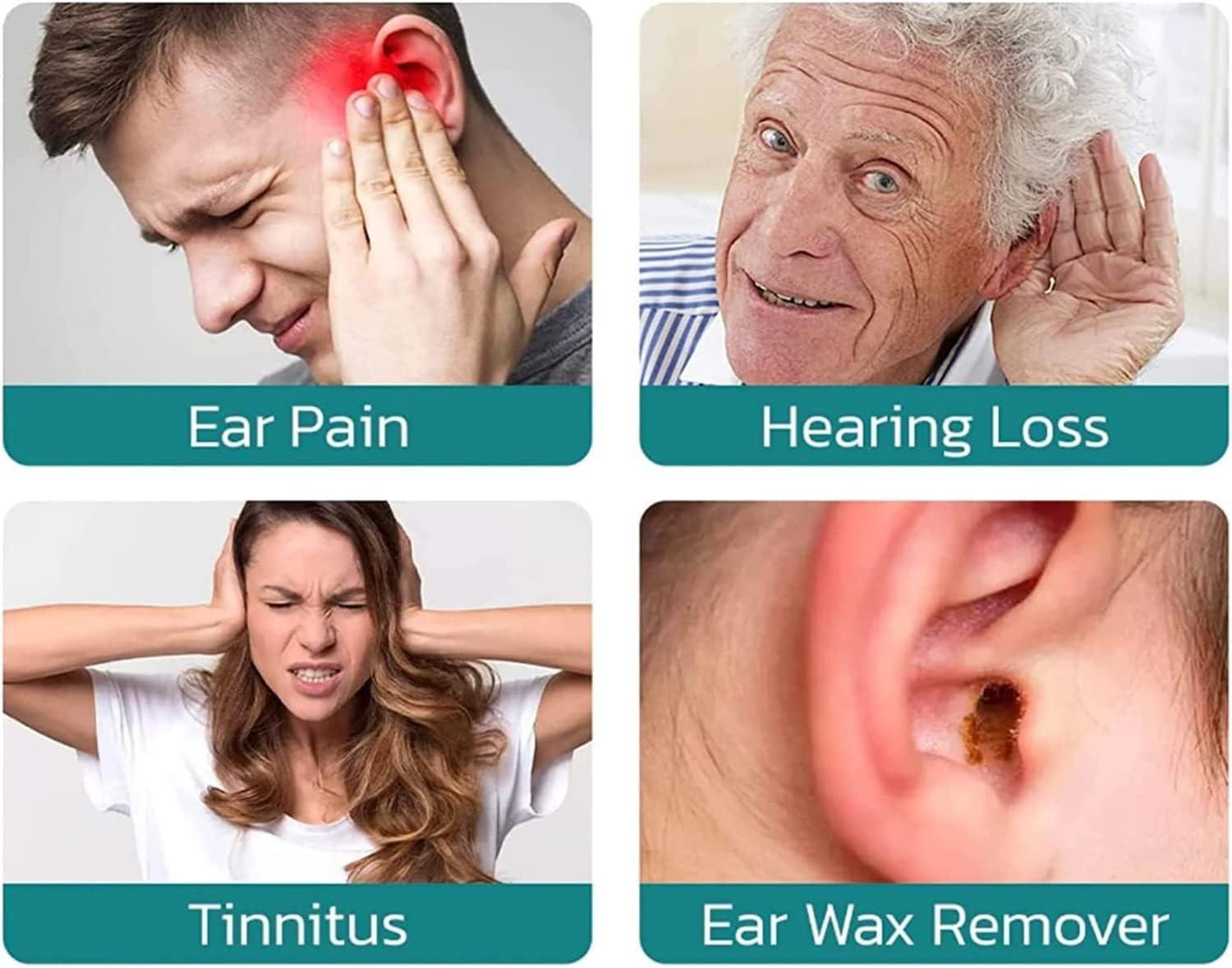 Japanese Ear Ringing Treatment Oil 10ml - Natural Herbal Tinnitus ...