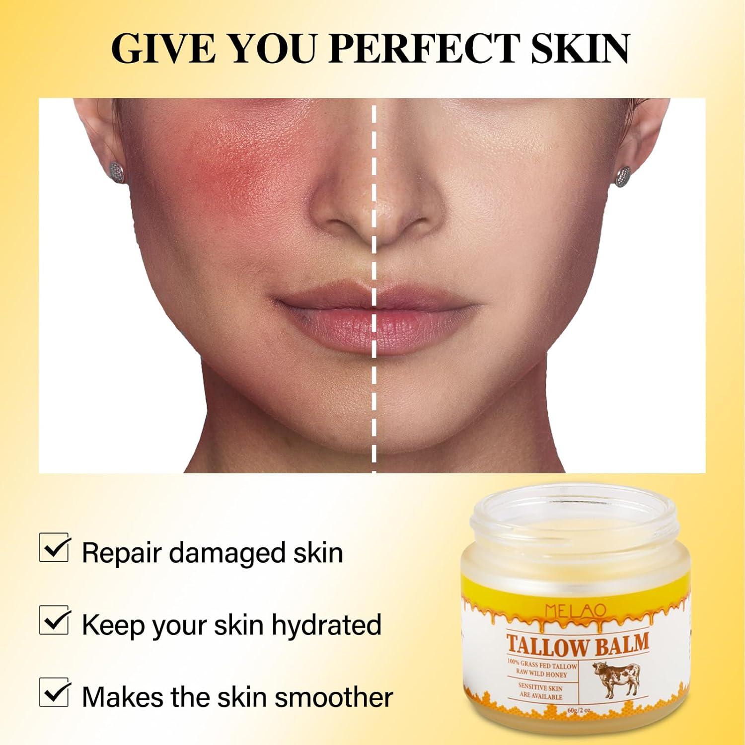 Natural Beef Tallow Cream - Nourishing Body Lotion for Sensitive Skin ...