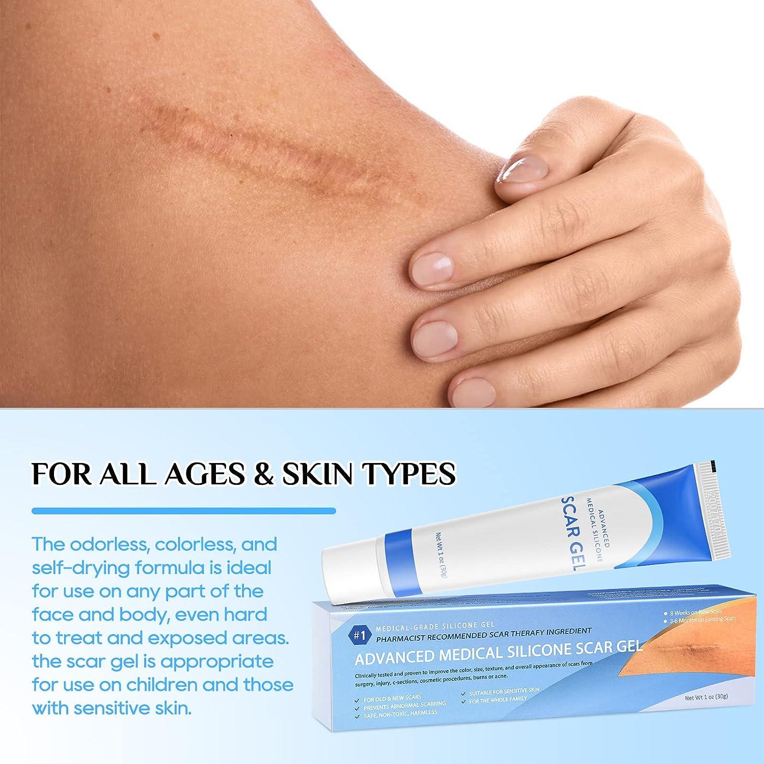 Silicone Scar Gel - Physician Formulated Treatment Cream for Keloids, C ...