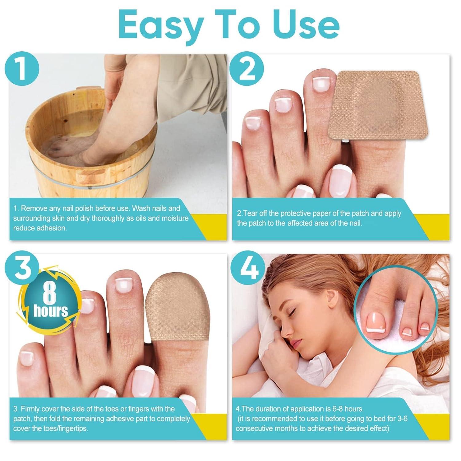 Nighttime Renewal Toe Nail Patches for Fungus - Fast & Effective Foot ...