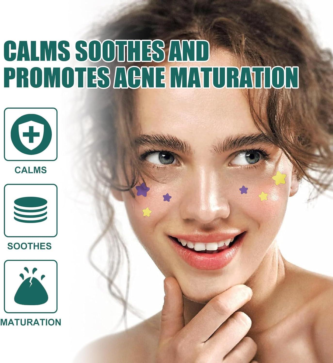 Pimple Patches Hydrocolloid Acne Patch for Face & Body | Calms ...