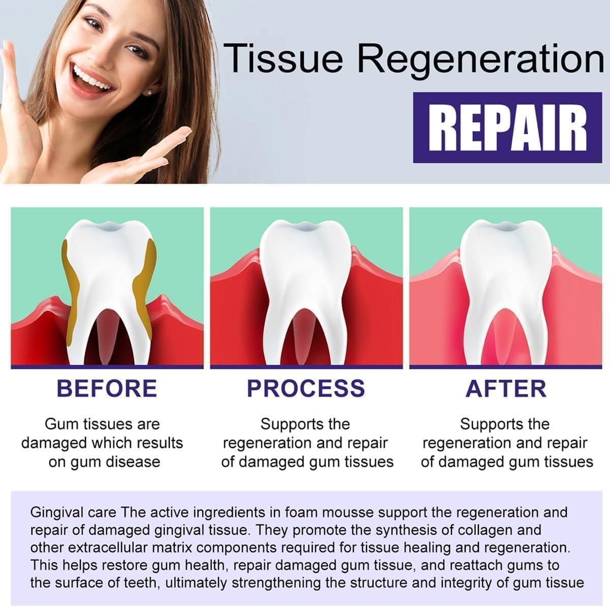 EXQST Gum Treatment Foam Gum Tissue Regeneration and Repair Deep Stain ...