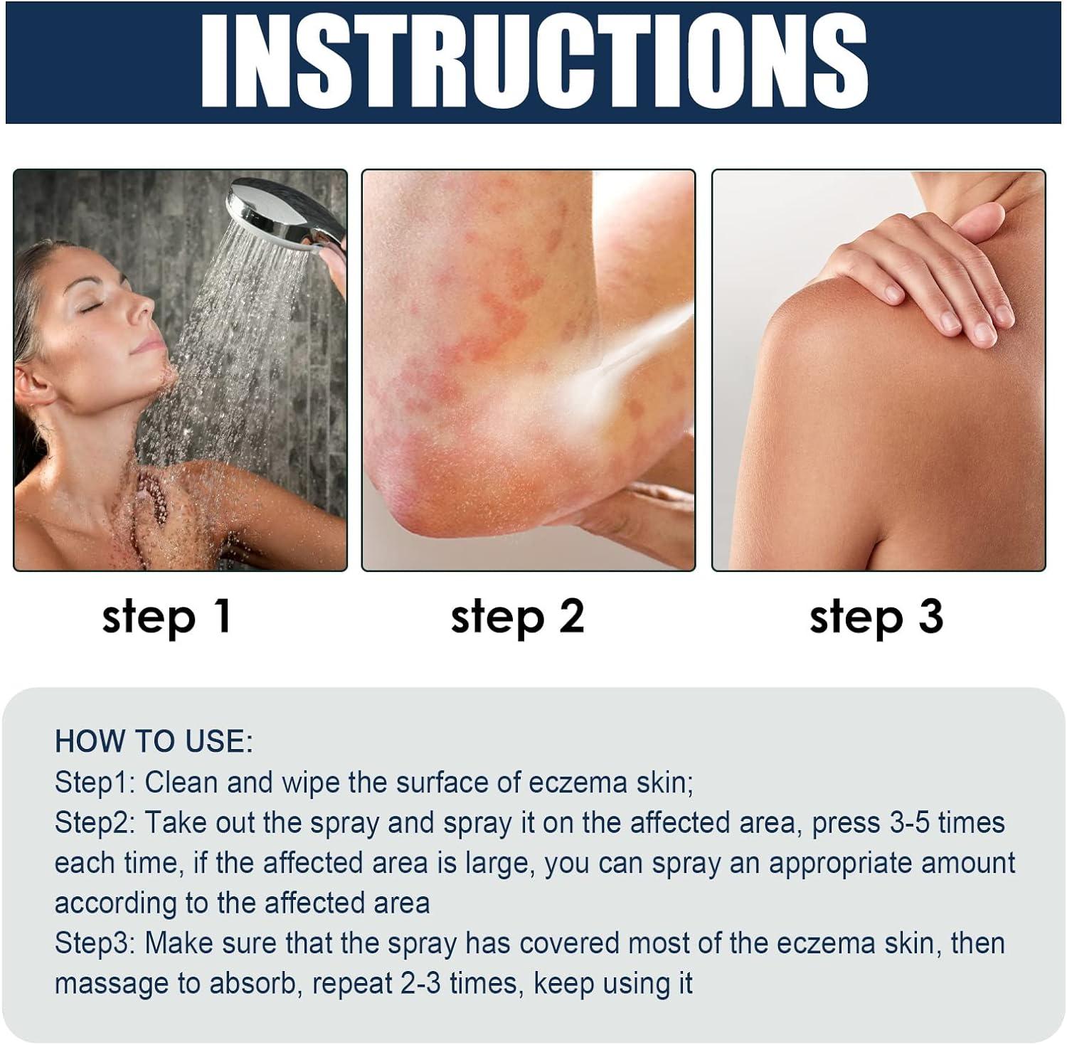 MUTYNE Eczema Therapy Spray: Natural Relief for Fast-Acting Itch Relief and Hydration - 2PCS