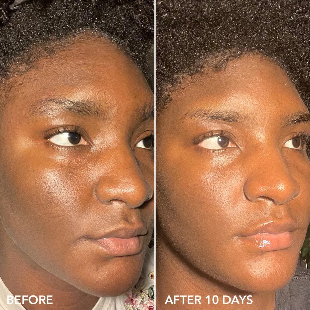 Dr. Dennis Gross C + Collagen Brighten & Firm Serum - 1.0 fl oz | Buy ...