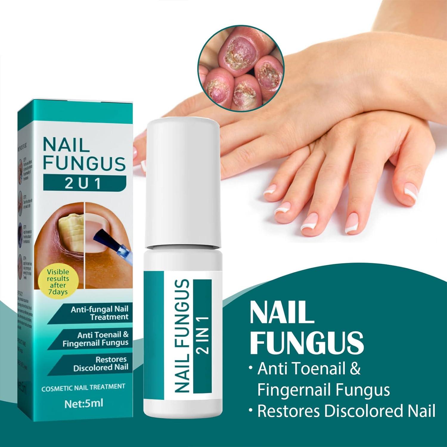Nail Fungus Treatment for Toenail Nail Repair Kit with Glass Nail File ...