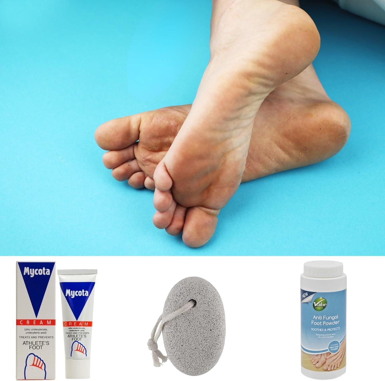 Athletes Foot Treatment Bundle: Mycota Cream 25g, Value Health ...
