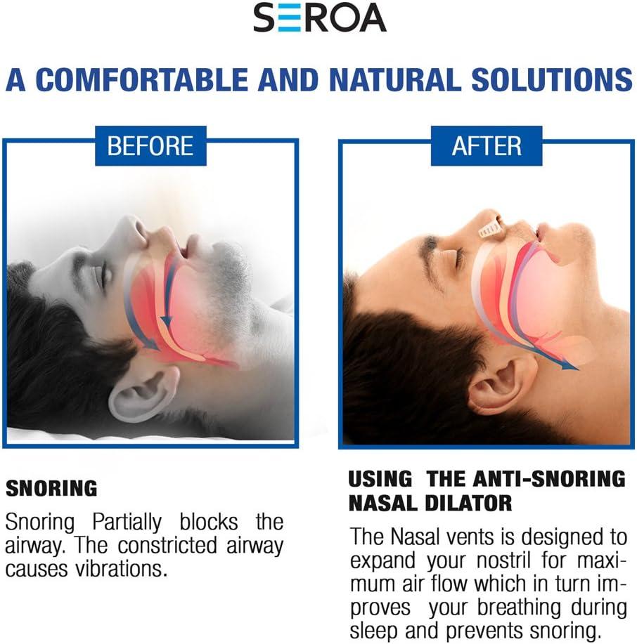 Premium Anti Snoring Nose Vents - Stop Snoring Solution for Comfortable ...