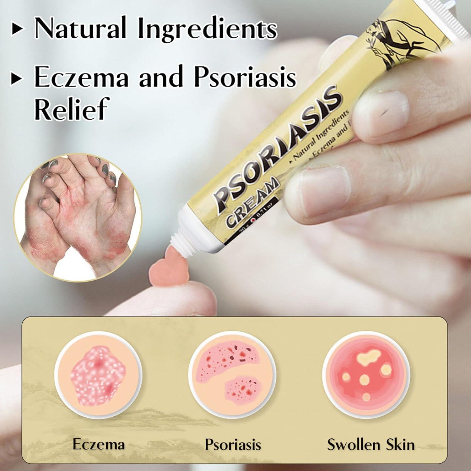 Buy Psoriasis & Eczema Creams | Natural Herbal Moisture Creams & Anti ...