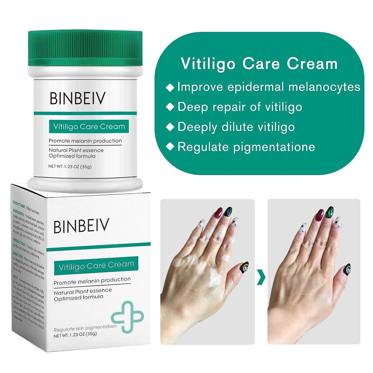 BINBEIV Vitiligo Care Cream - Pigmentation Regulating Formula | Fade ...