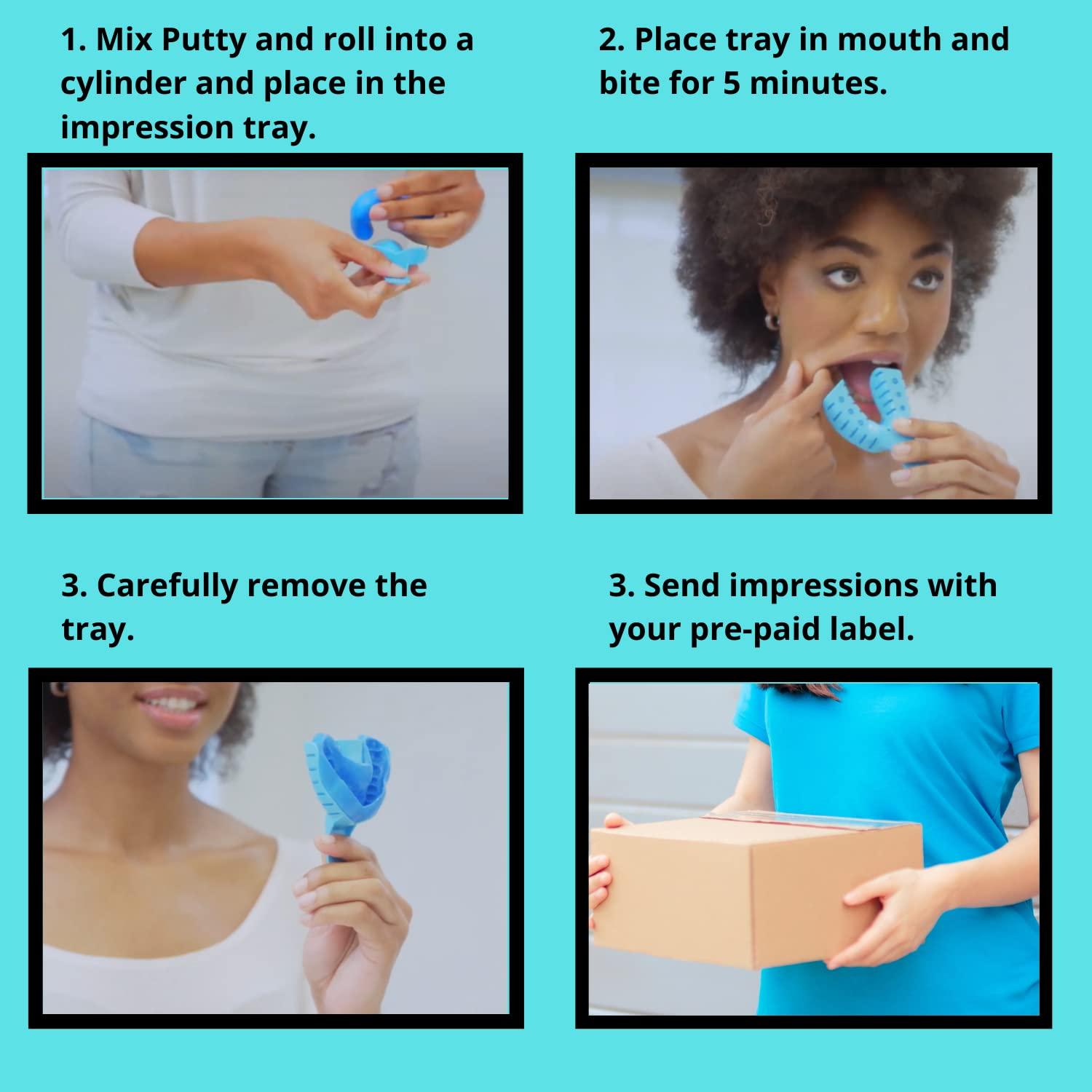 ClearRetain Upper Orthodontic Retainer - Prevent Teeth Shifting ...