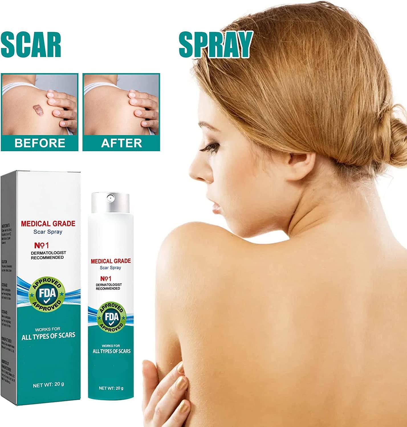 2pcs Advanced Scar Remove Spray & Cream Set (20g) - Physician ...