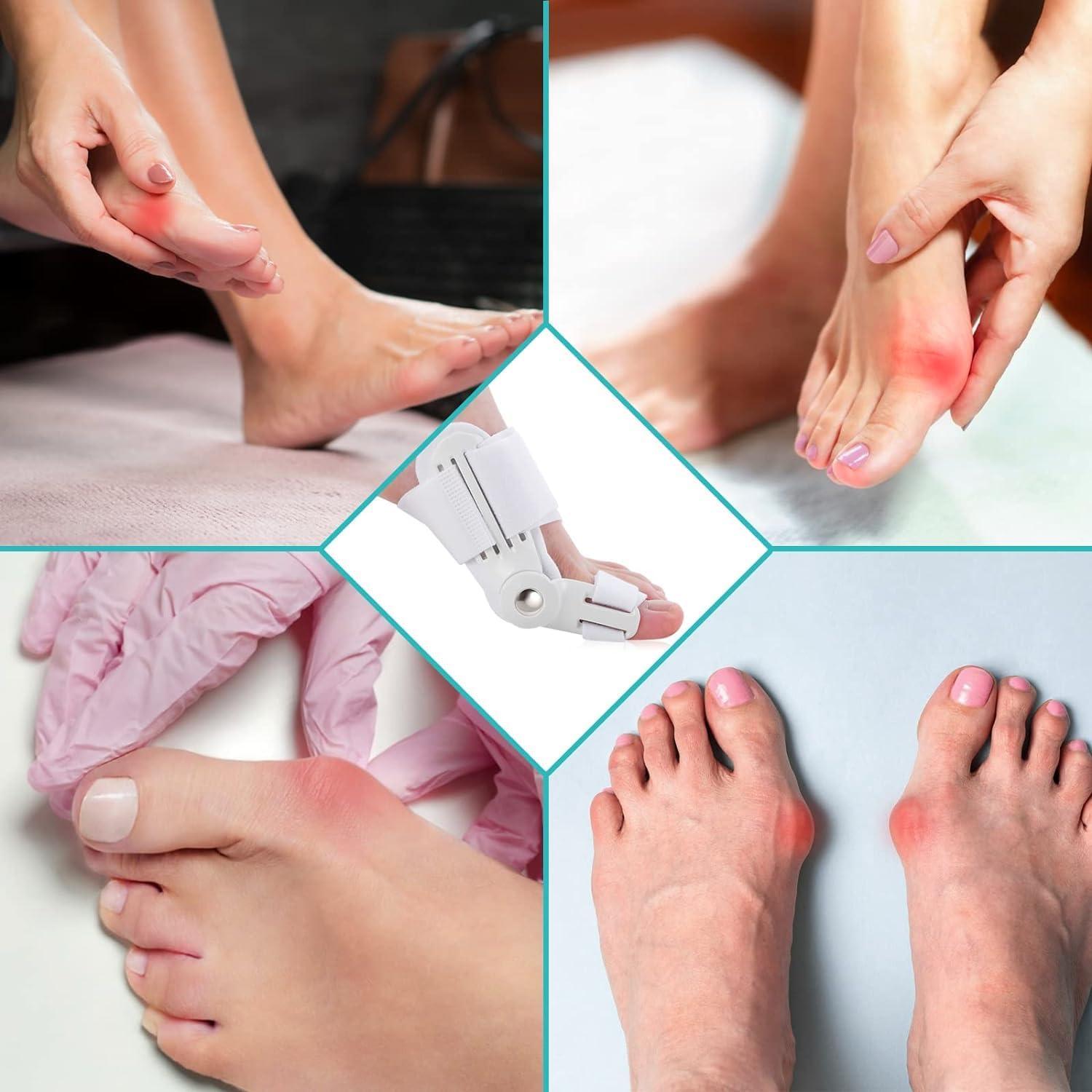 Melarqt Hallux Valgus Correction - Adjustable Toe Spreader & Rail for ...