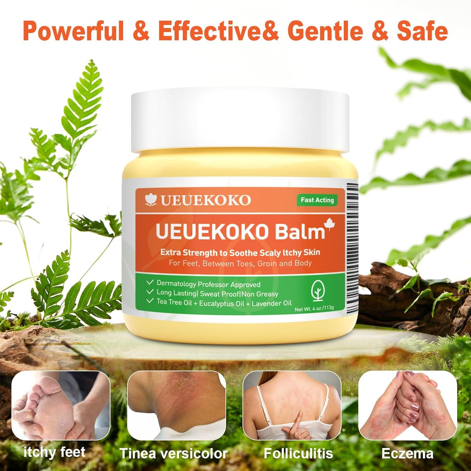 Heat Rash Cream for Eczema, Psoriasis, and Itchy Skin - 4 Fl Oz (Pack ...