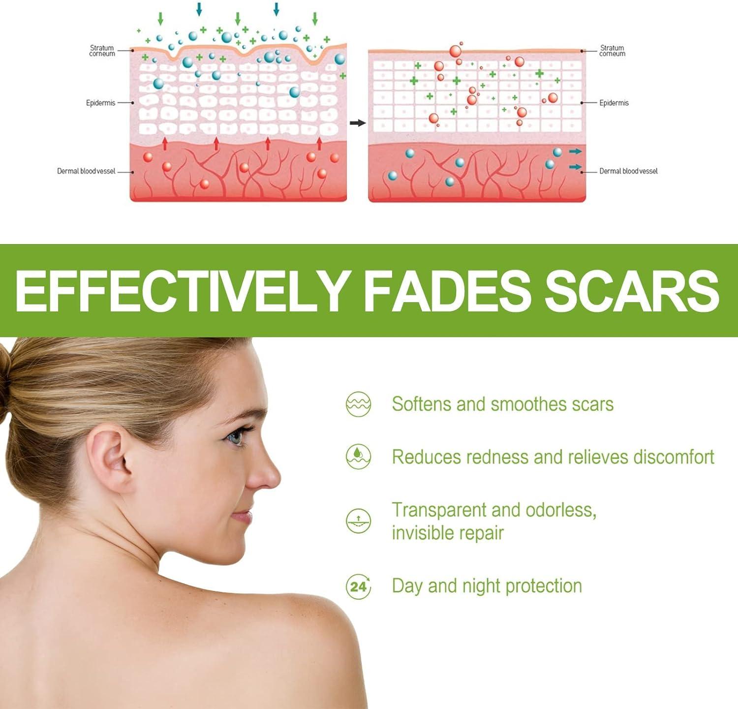 Goopgen Advanced Scar Repair Serum - Medical Grade, Lighten Acne ...