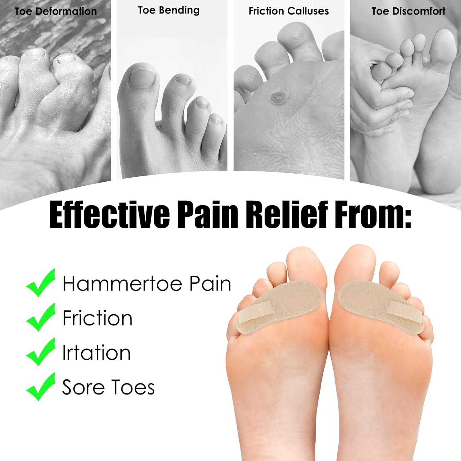 Hammer Toe Crest Cushion 2PCS - Toe Prop Support for Hammertoe, Hallux ...