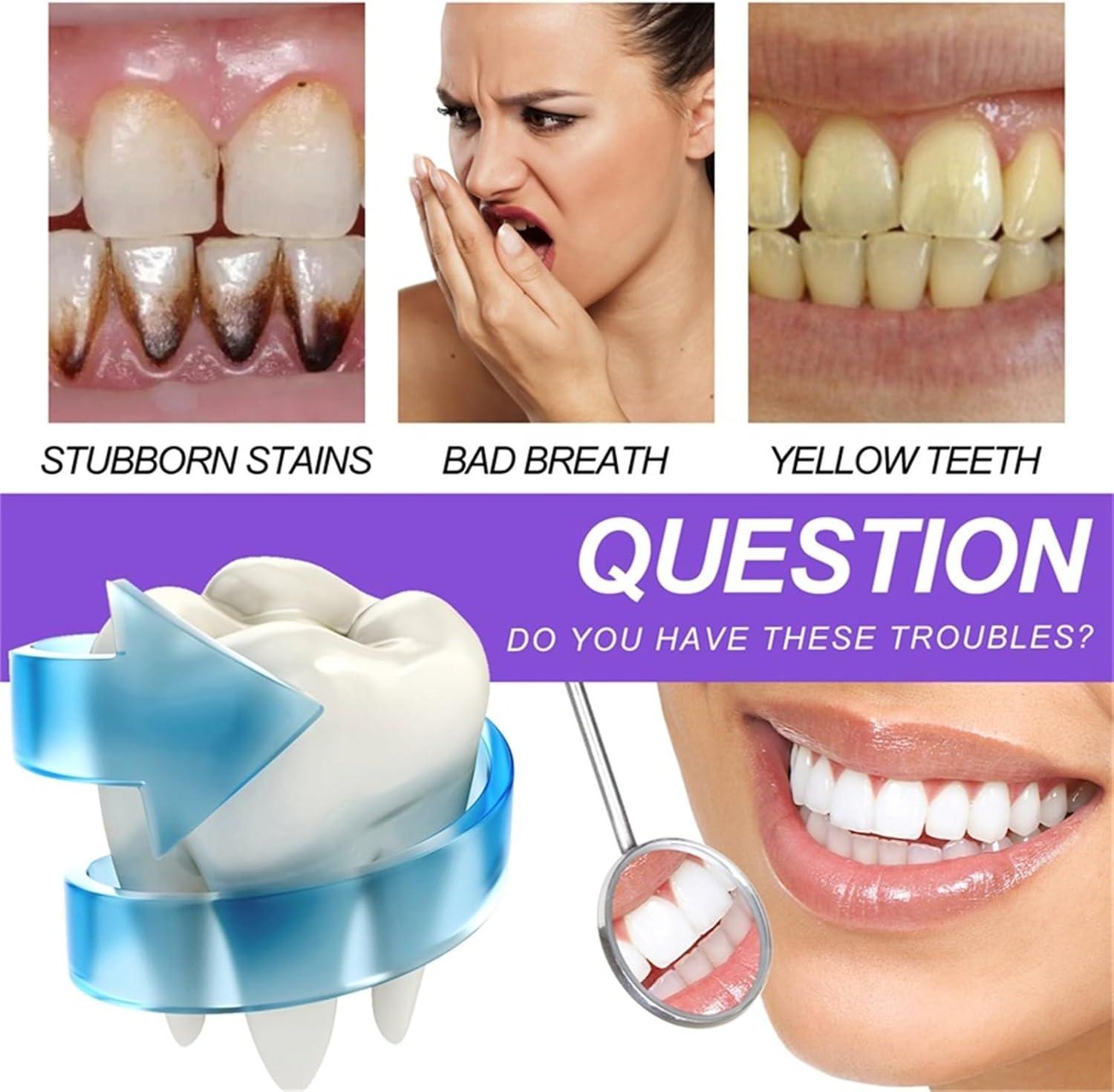 V34 Color Correction Tooth Whitening - Purple Tooth Stain Removal ...