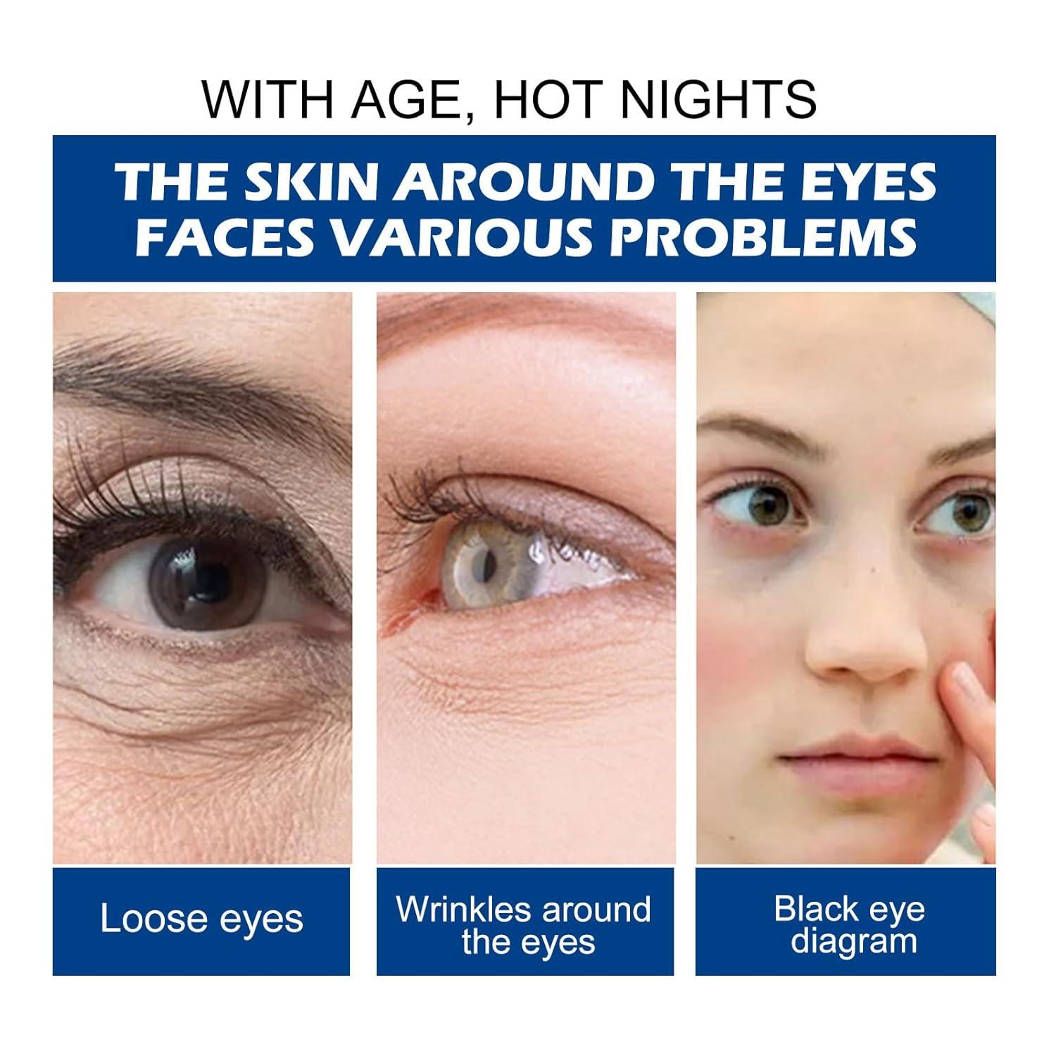Jasmine Ointment Plus: Anti-Wrinkle Eye Cream for Dark Circles ...