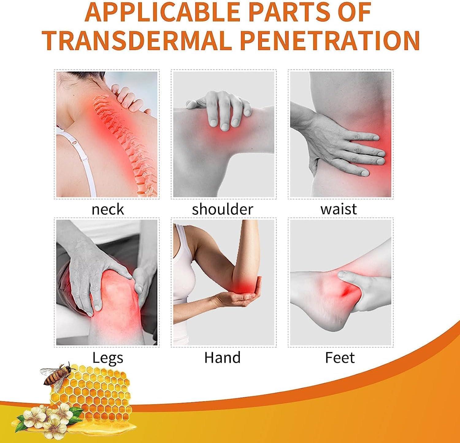 Bee Venom Gel Joint & Bone Therapy - Professional New Zealand Treatment ...