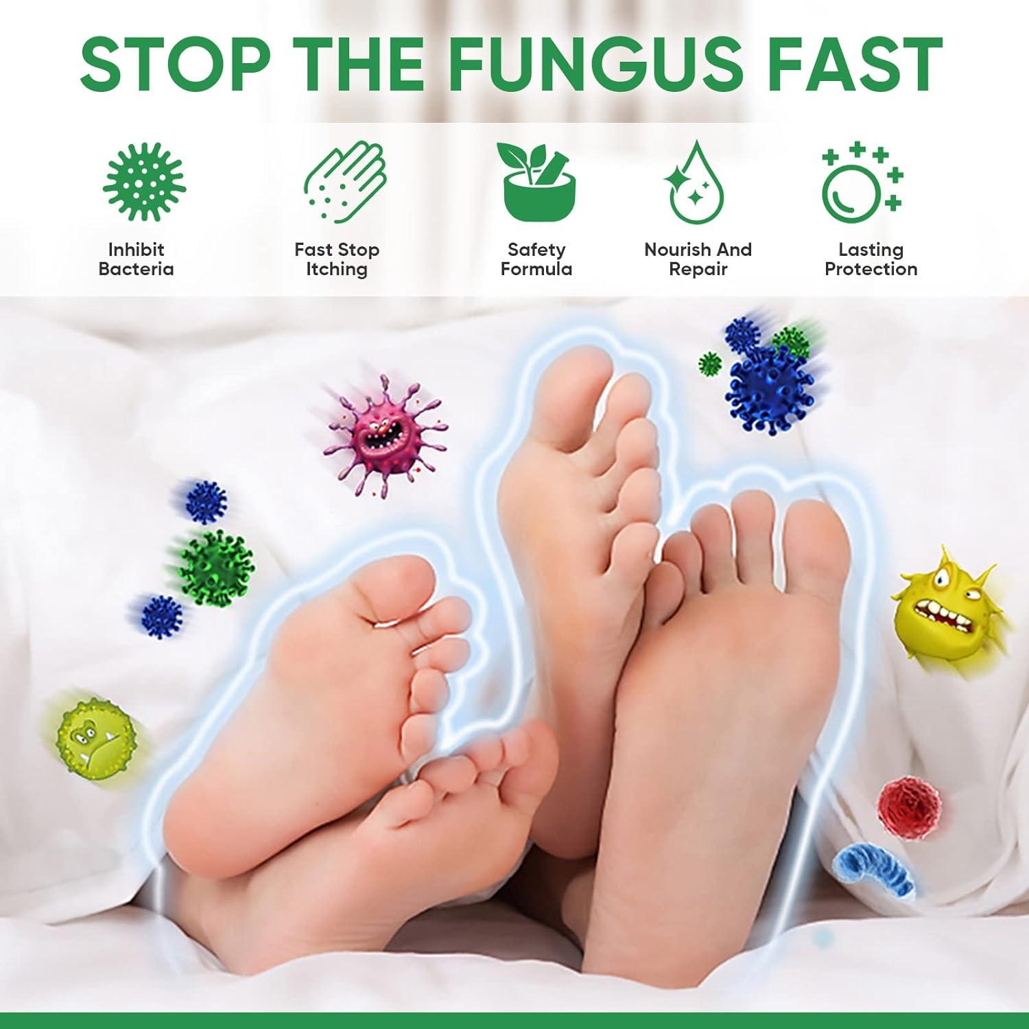 Natural Anti-Fungal Foot Spray for Athlete's Foot Treatment - Relieves ...
